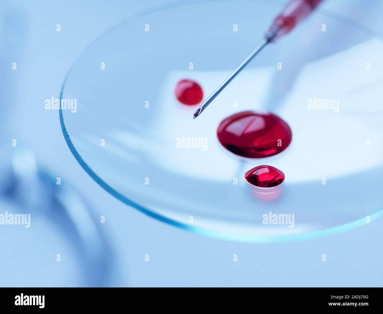 Blood sample. Drops of blood from a syringe on a watchglass Stock Photo ...