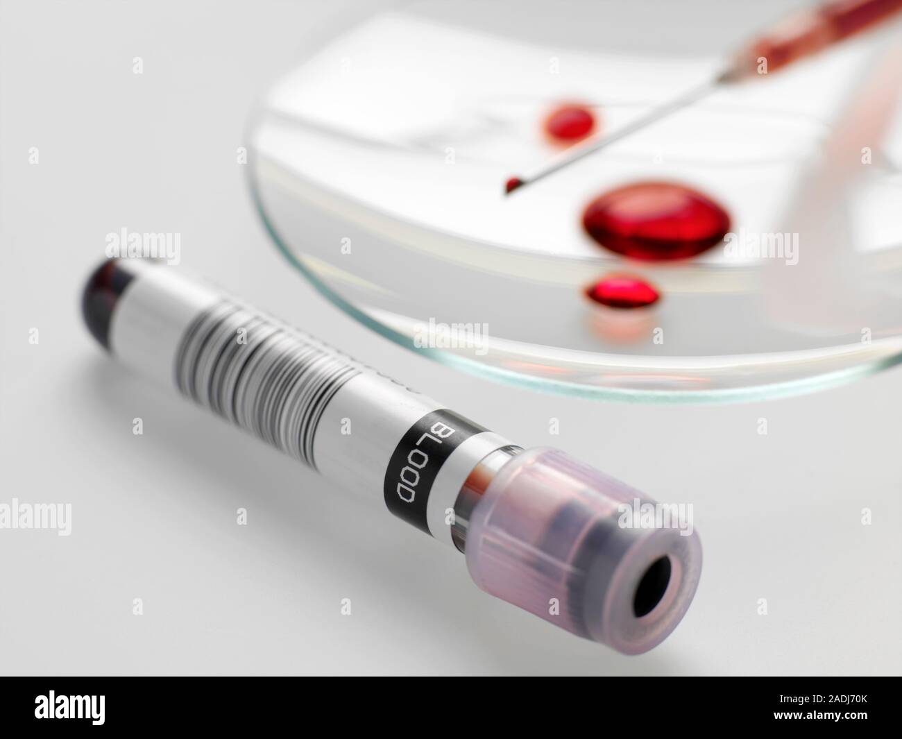 Blood sample. Sample tube in front of a watchglass with drops of blood ...