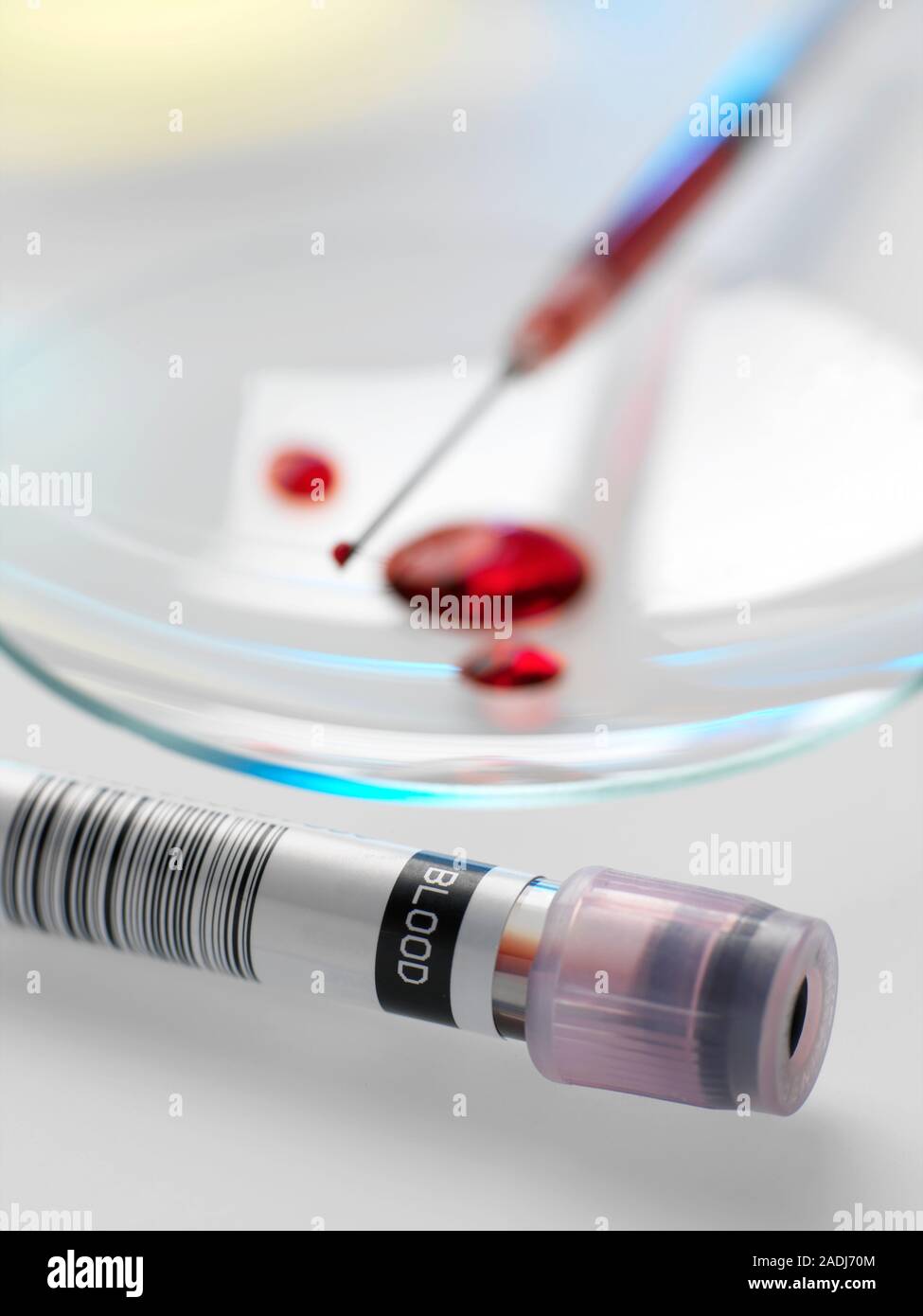 Blood sample. Sample tube in front of a watchglass with drops of blood ...