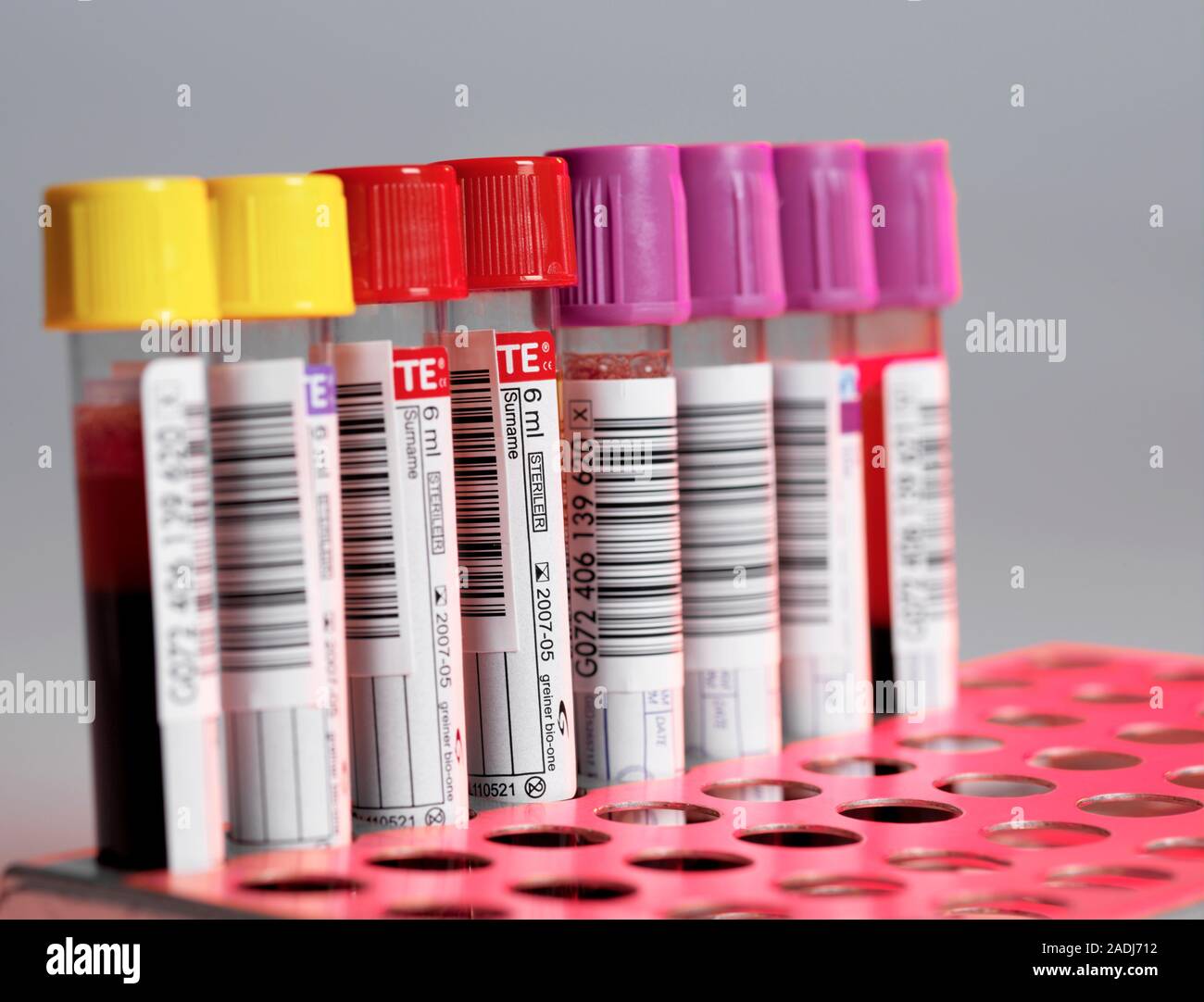 Blood samples. Blood sample tubes in a rack Stock Photo - Alamy