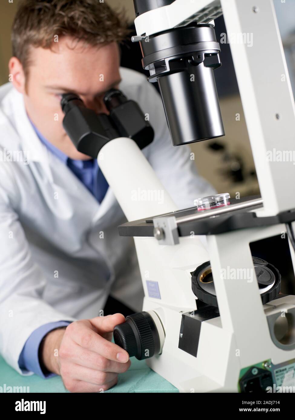 MODEL RELEASED. Blood analysis. Technician examining a blood sample ...