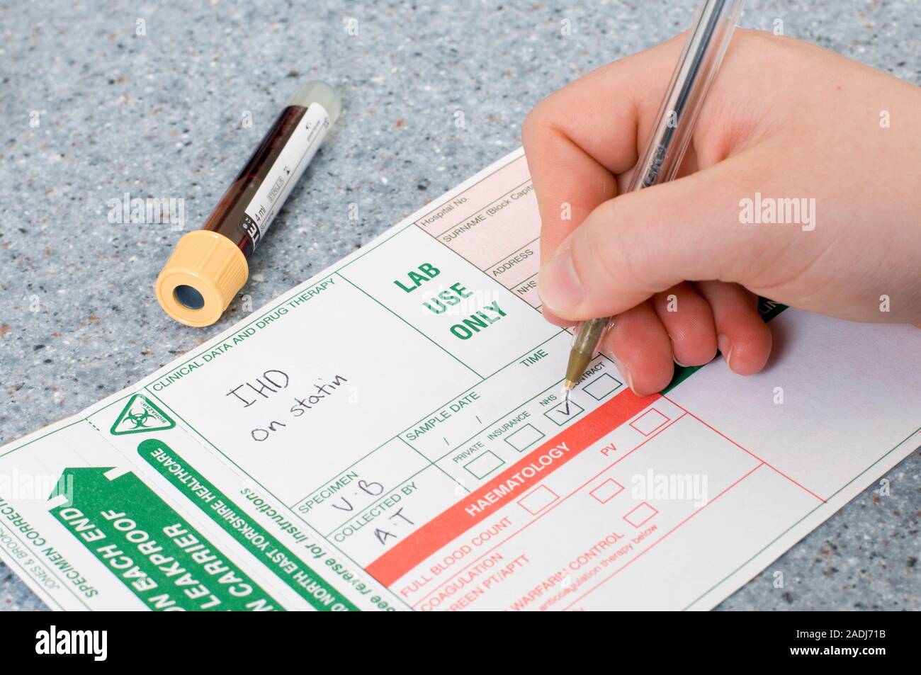 MODEL RELEASED. Blood testing. Health professional labelling an ...