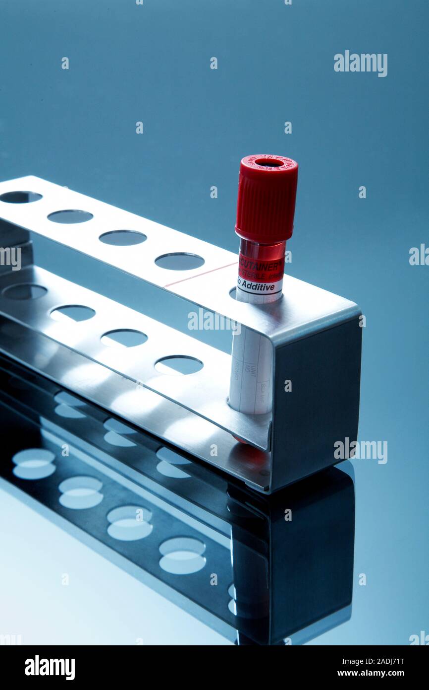 Blood sample in a tube holder Stock Photo - Alamy