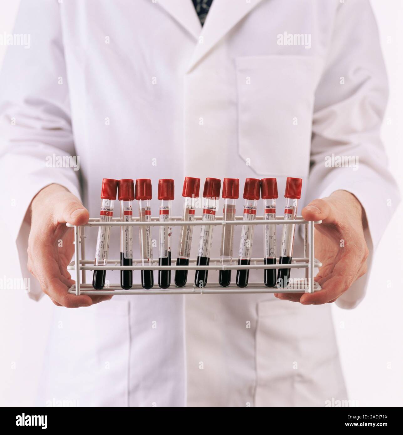 MODEL RELEASED. Blood samples. Doctor carrying s rack of blood sample ...