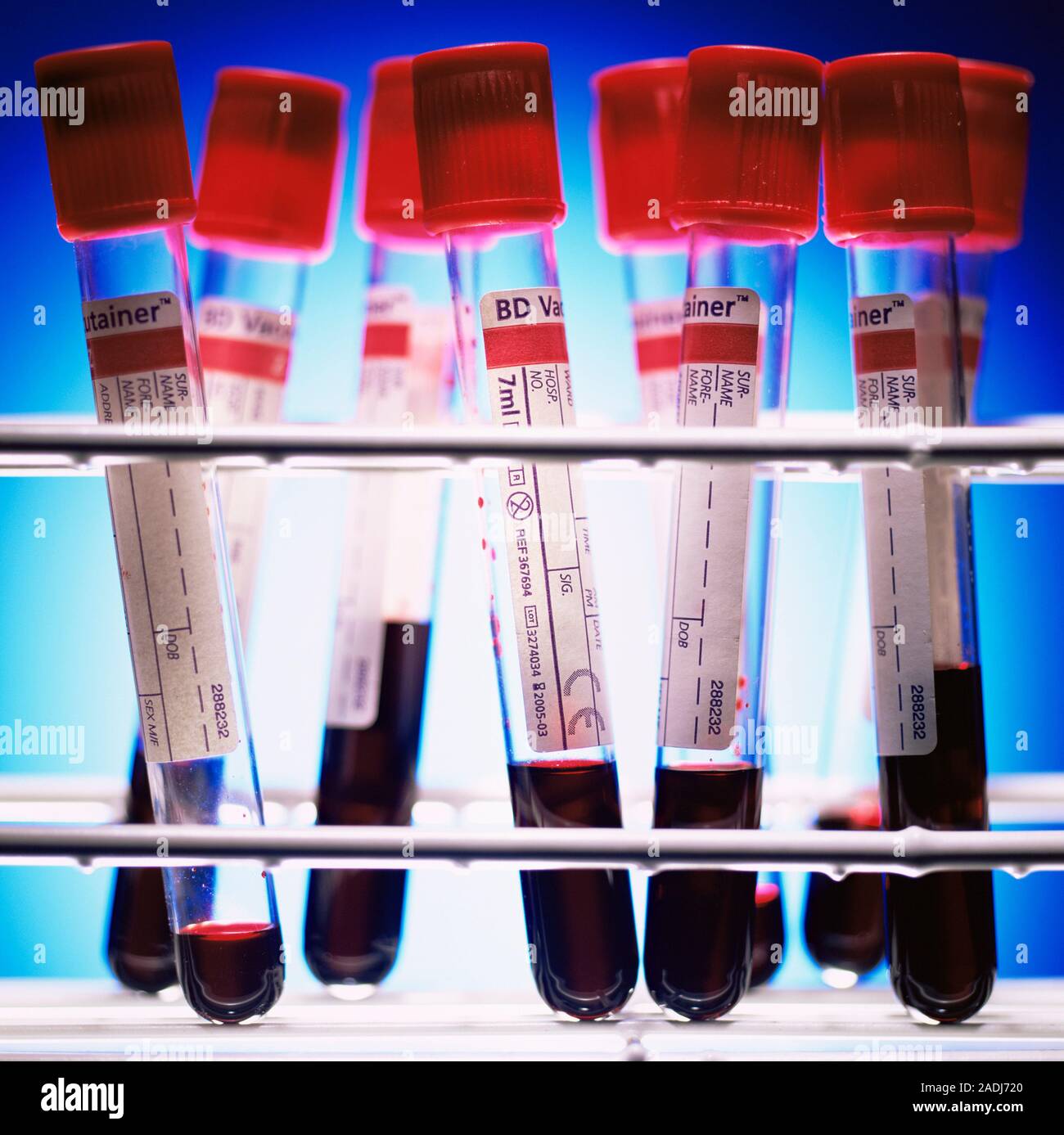 Blood samples in a rack Stock Photo - Alamy