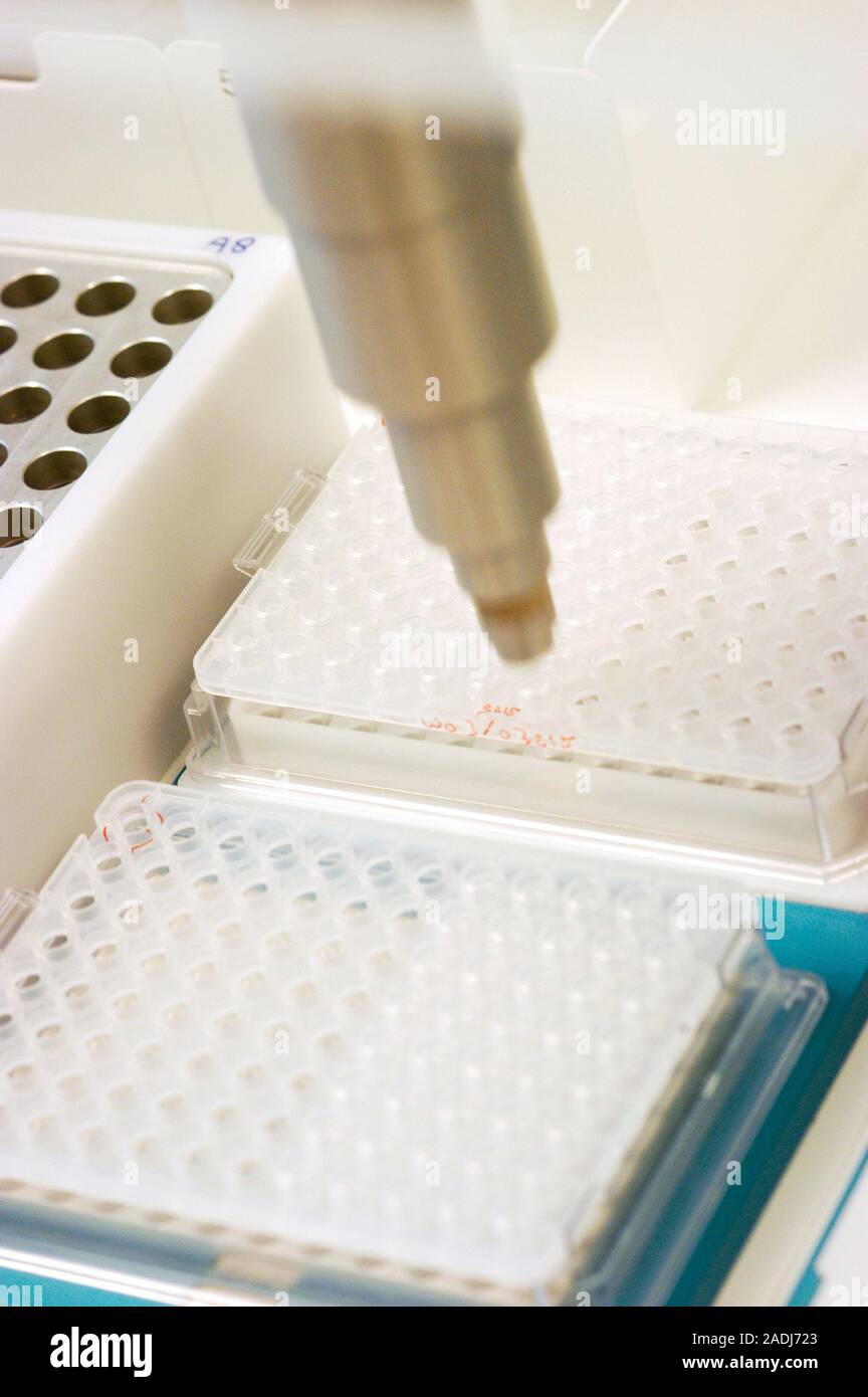 Testing for genetic blood disorders. Multi-well sample tray filled with ...