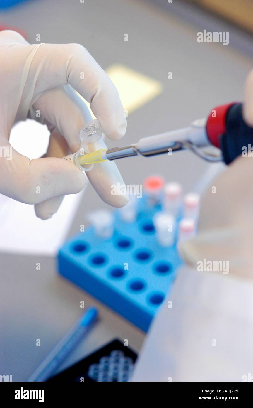 Testing for genetic blood disorders. Researcher pipetting a blood ...