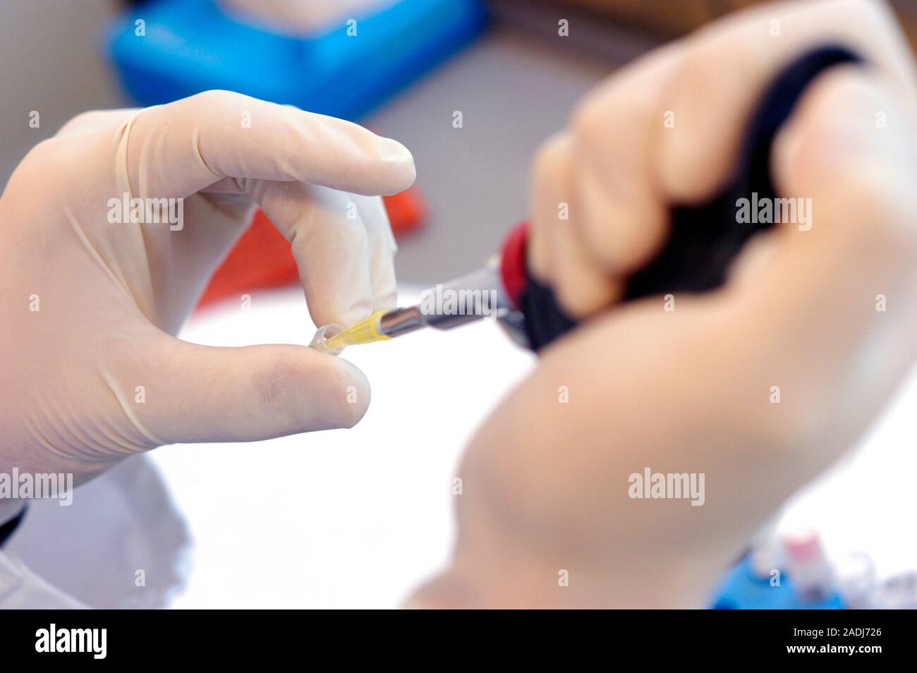 Testing for genetic blood disorders. Researcher pipetting a blood ...