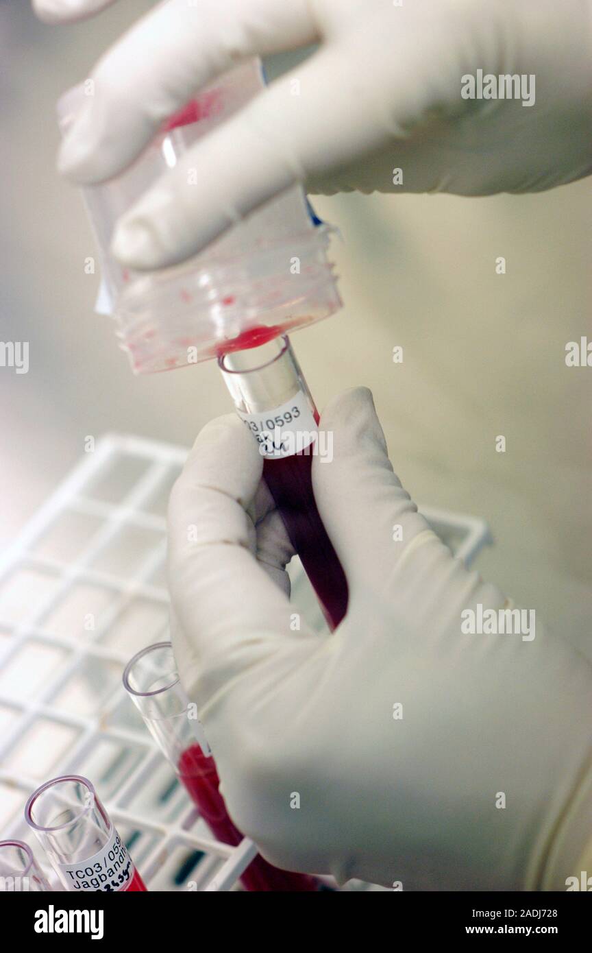 Blood sample. Researcher transferring a blood sample into test tubes ...