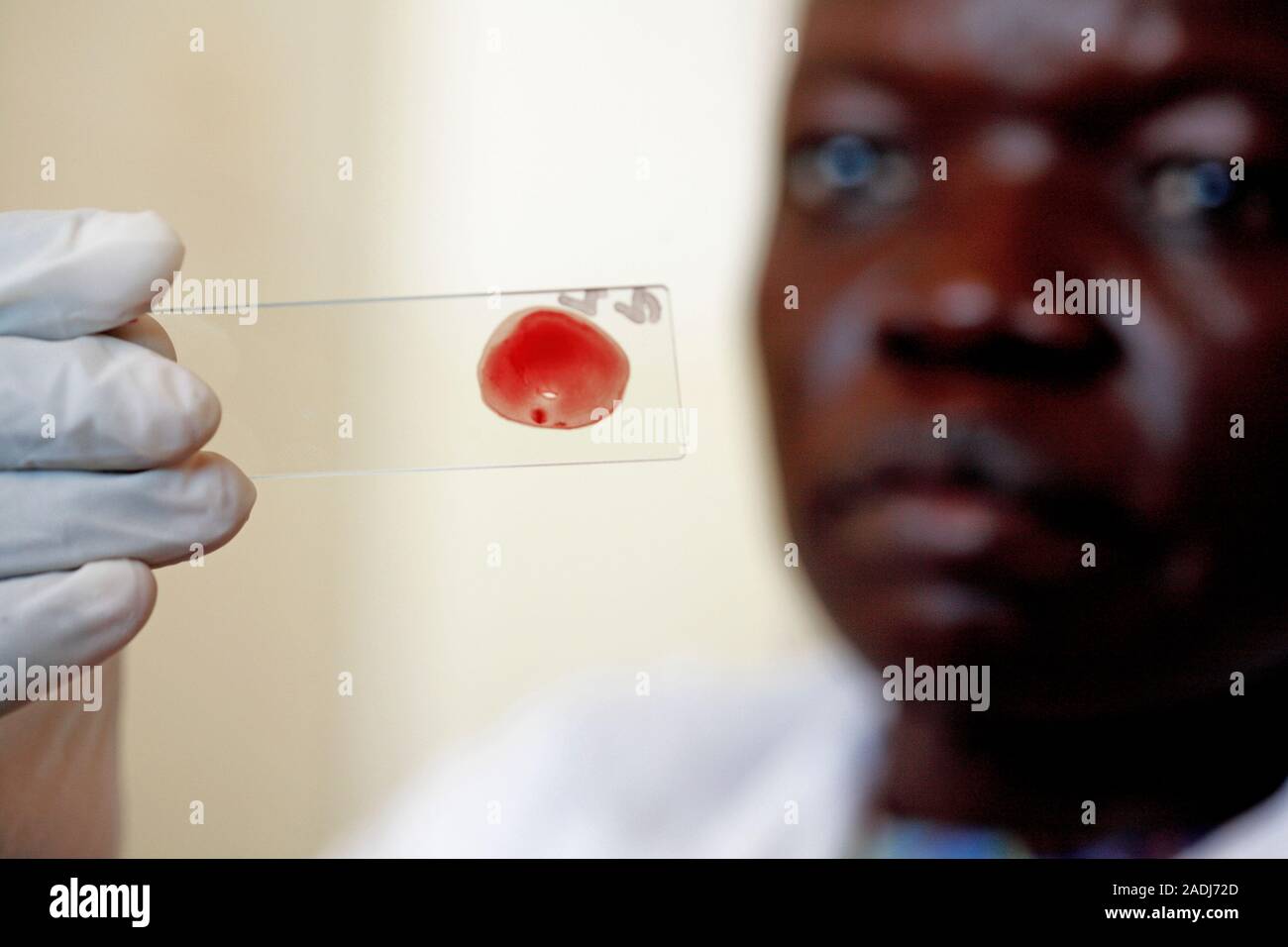 MODEL RELEASED. Blood sampling. Microbiologist analysing a blood sample ...