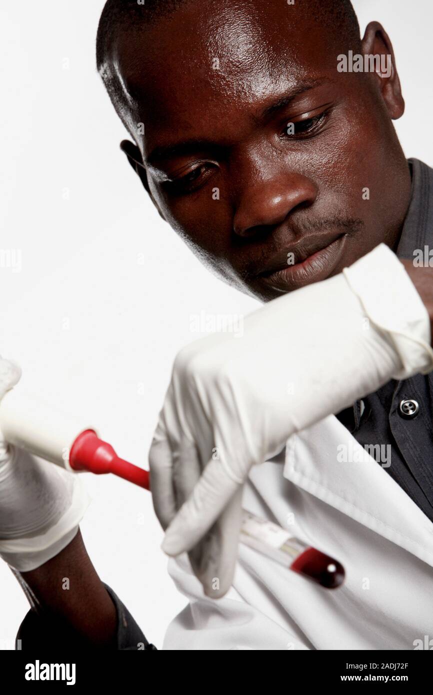 MODEL RELEASED. Blood research. Haematologist pipetting a blood sample ...