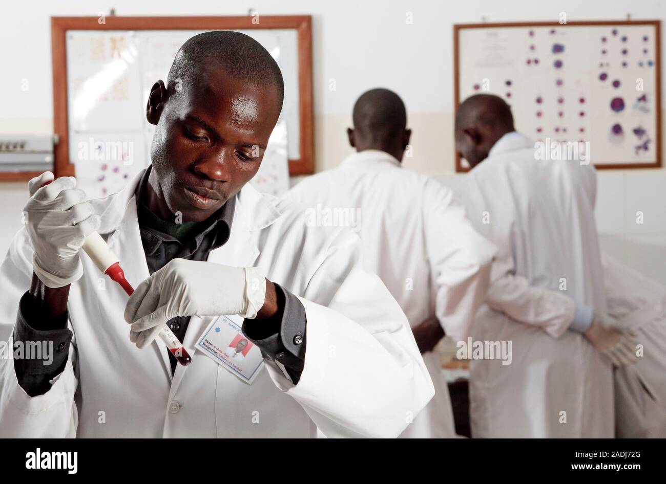 MODEL RELEASED. Blood research. Haematologist pipetting a blood sample ...