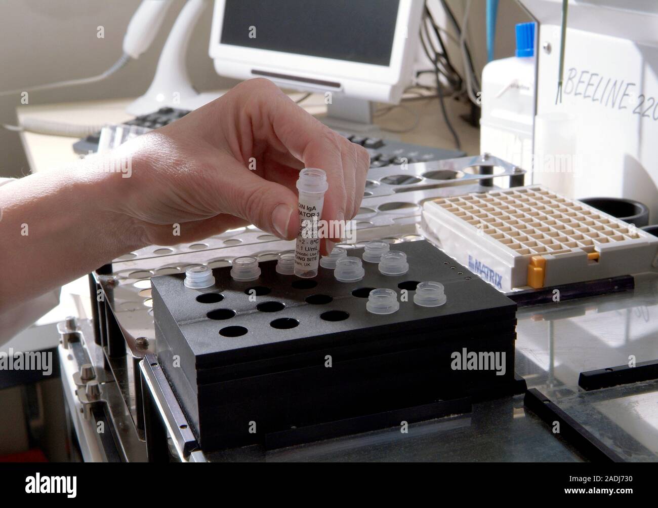 MODEL RELEASED. Semi-automated ELISA blood test. Samples being prepared ...