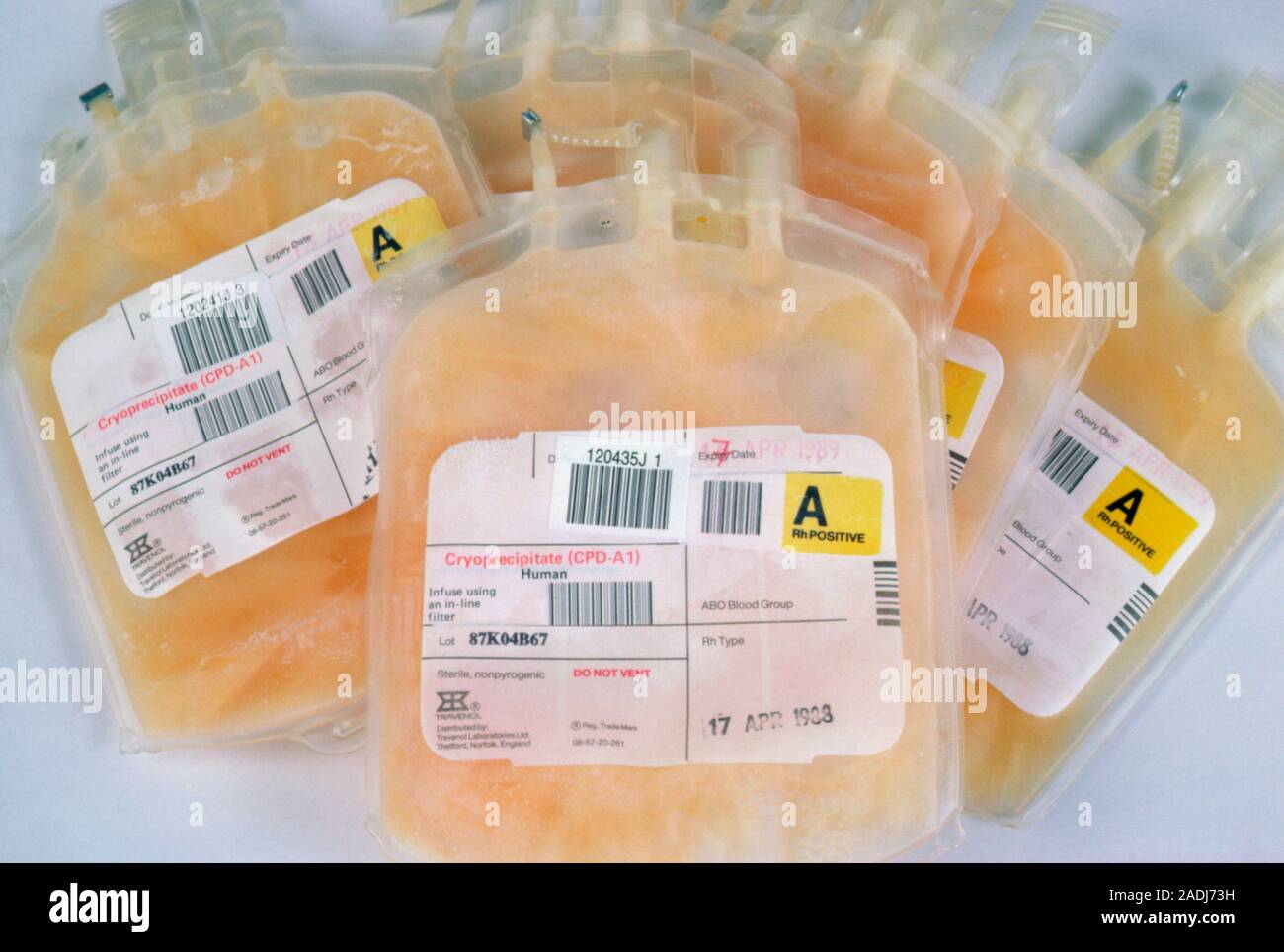 Blood products: transfusion bags containing human cryoprecipitate (CPD ...