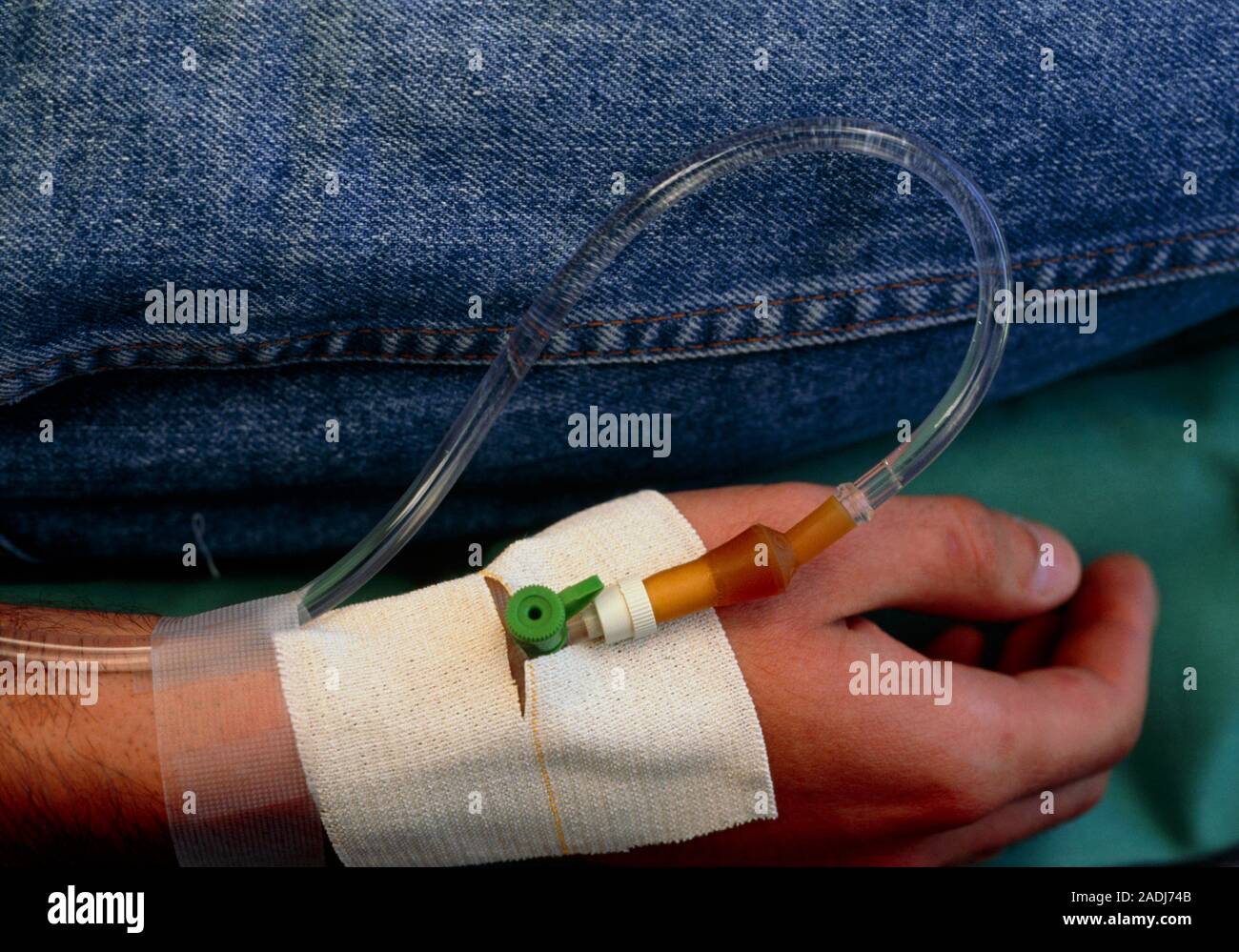 An intravenous drip inserted in a vein on a patient's hand. An ...