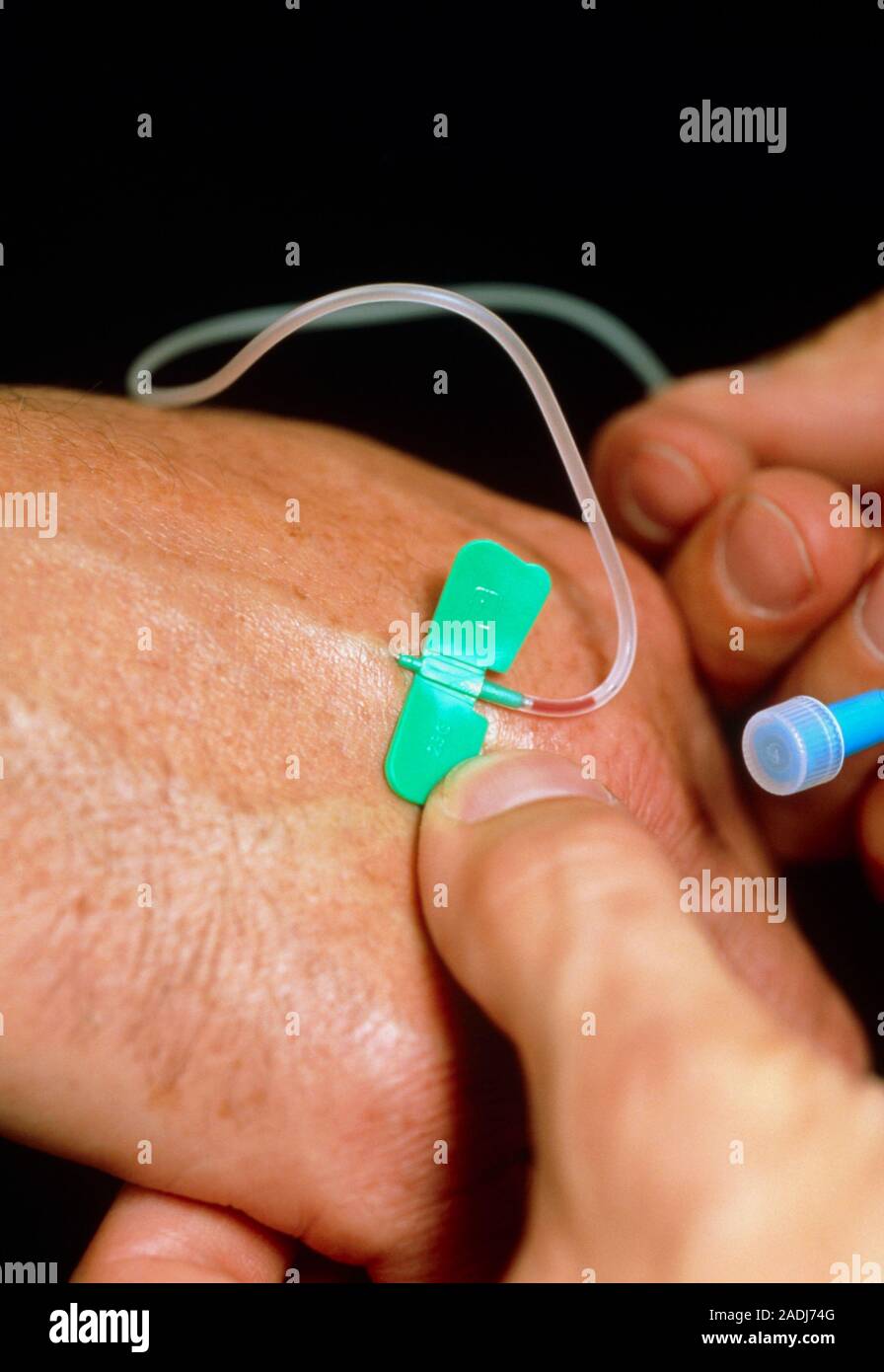A hollow needle known as a butterfly cannula being inserted into a vein ...
