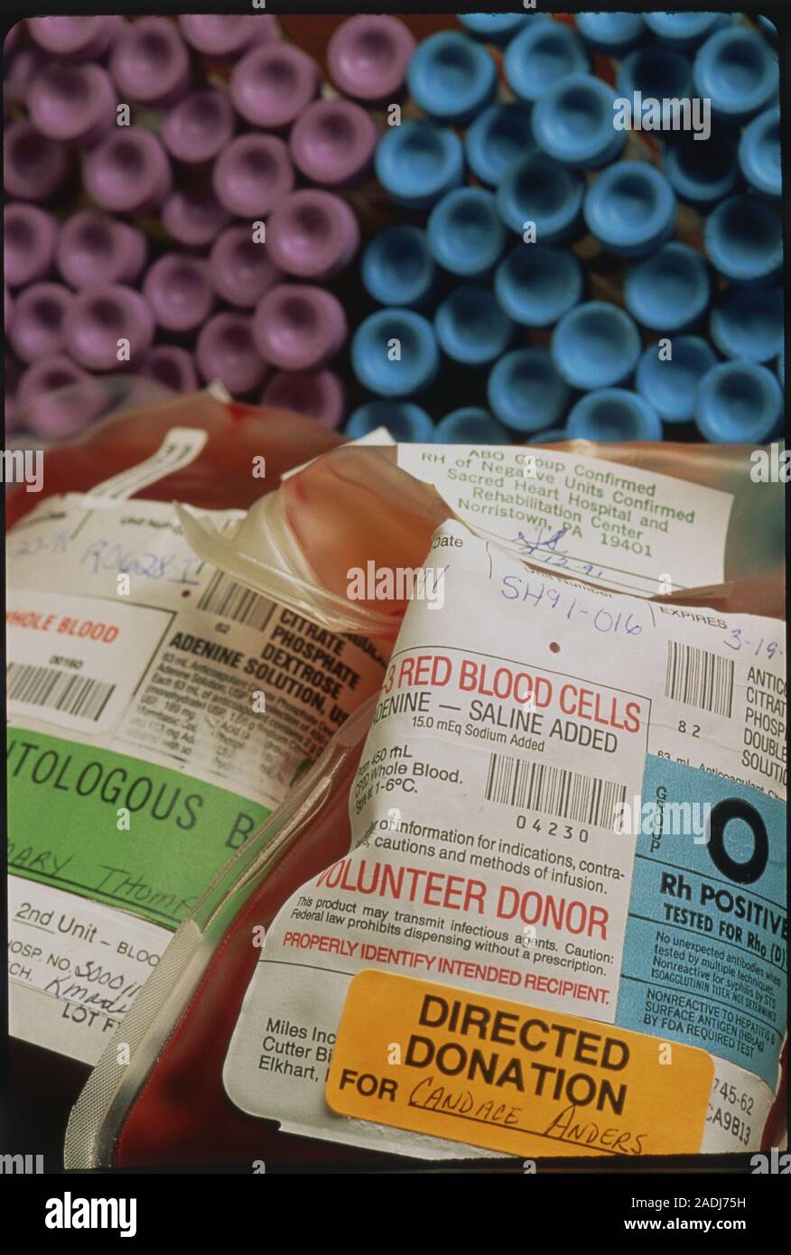 Blood samples. Sample bags of blood received from volunteer donation ...