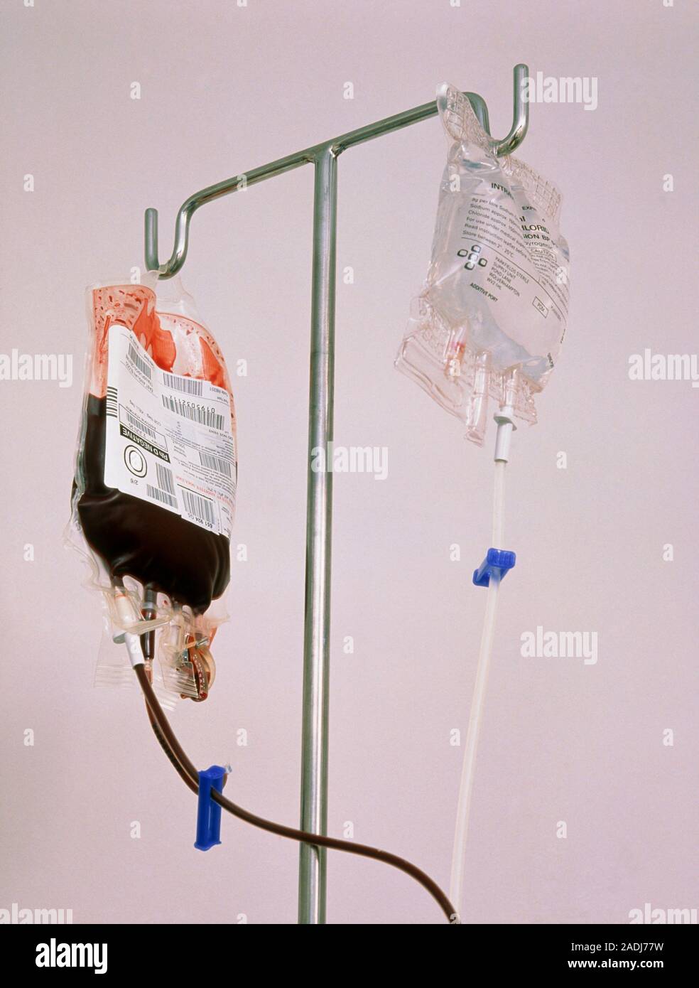 Bag of blood. This blood bag hanging from a stand is used for blood ...