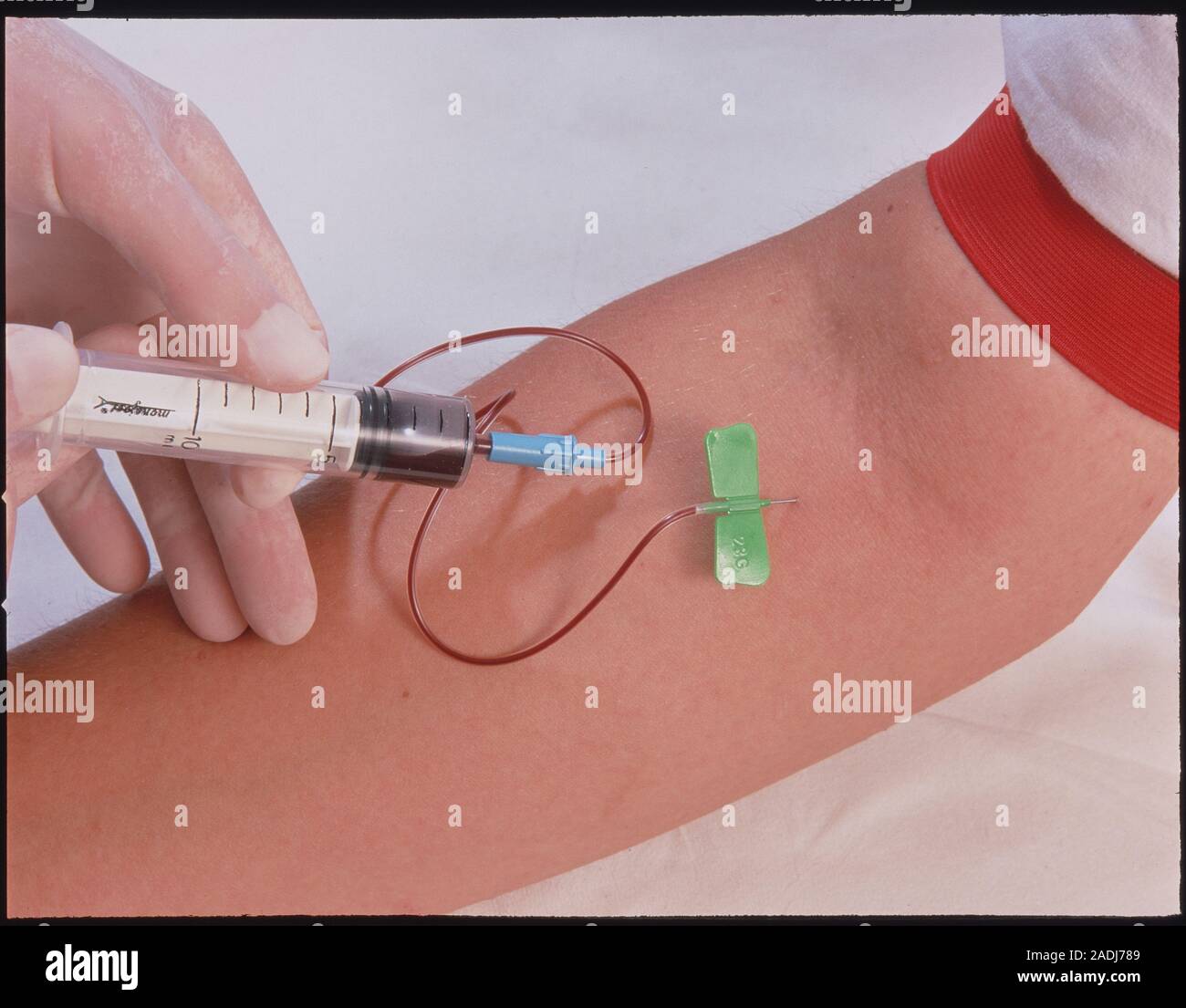 Blood sampling. Doctor's gloved hands use a syringe with a tube and ...