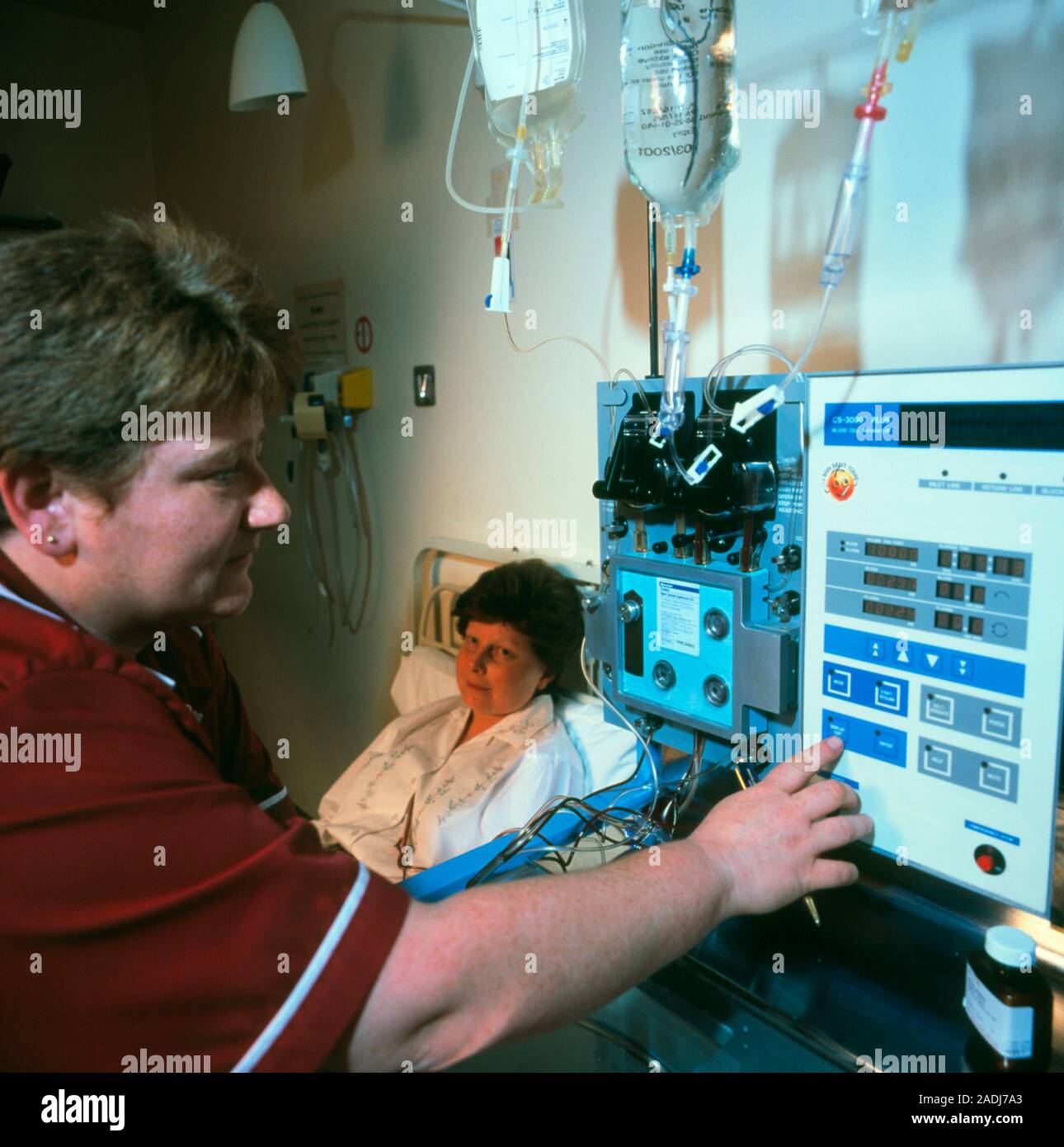 Blood stem cell harvesting. Woman attached to a blood cell separating ...