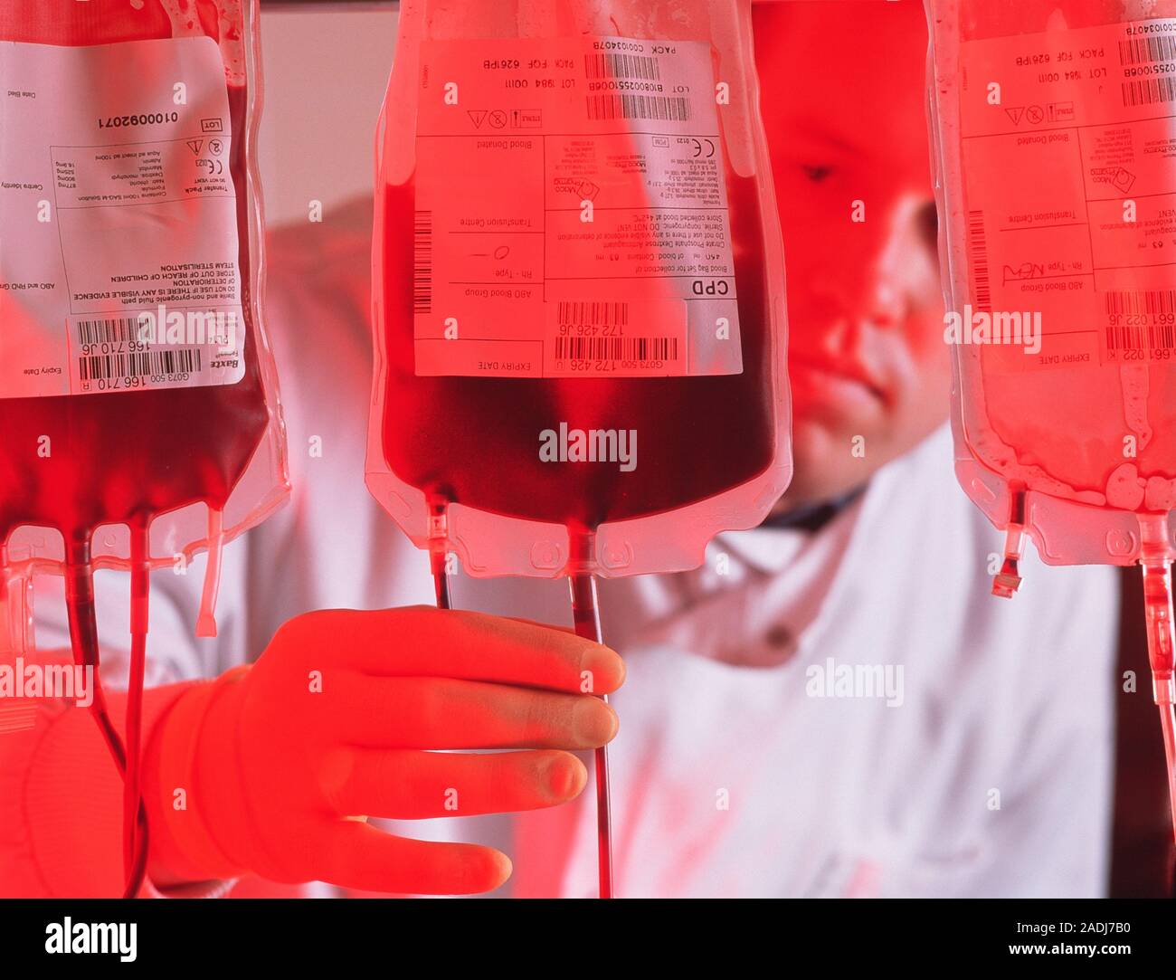 Blood processing. Technician filtering white blood cells from bags of ...