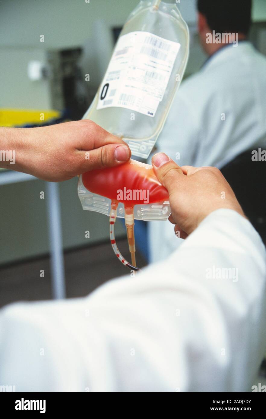 Separating blood. Laboratory technician squeezing a bag of donor blood ...