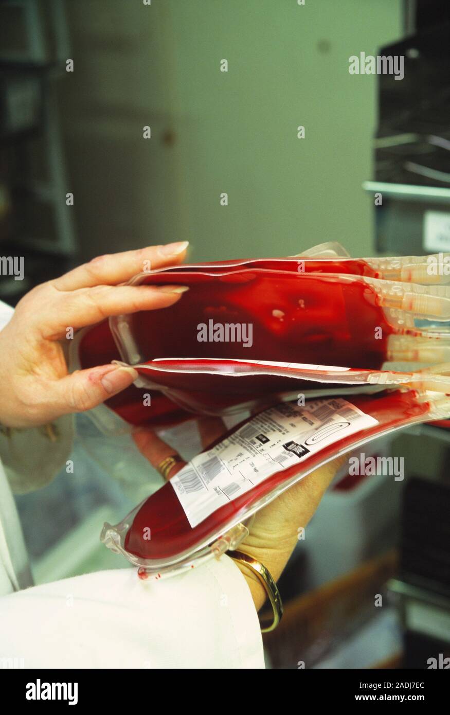 Newborn baby blood bags. Hands collecting several small blood bags for ...
