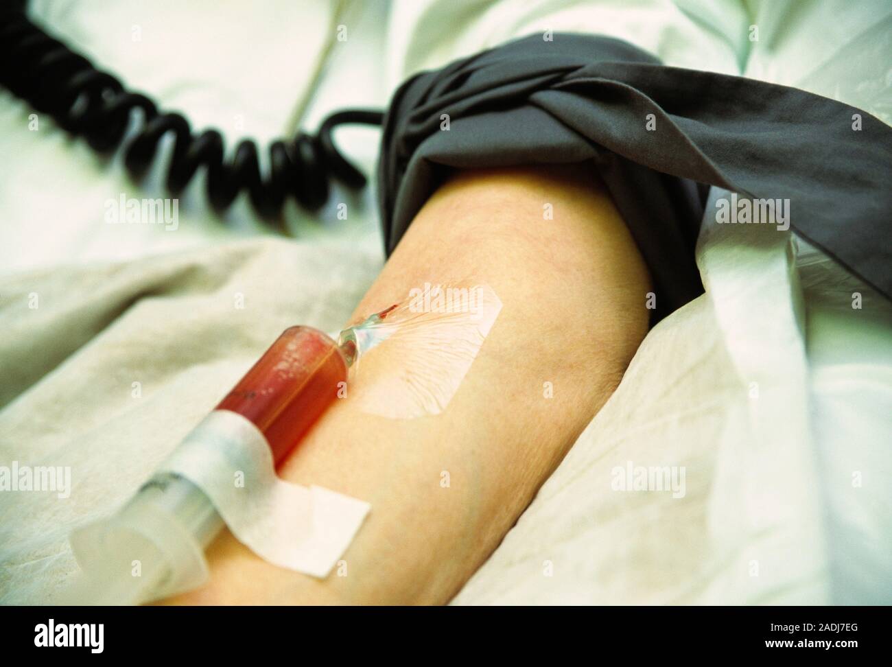 Taking blood. Syringe filling with blood from a patient's arm vein. The ...