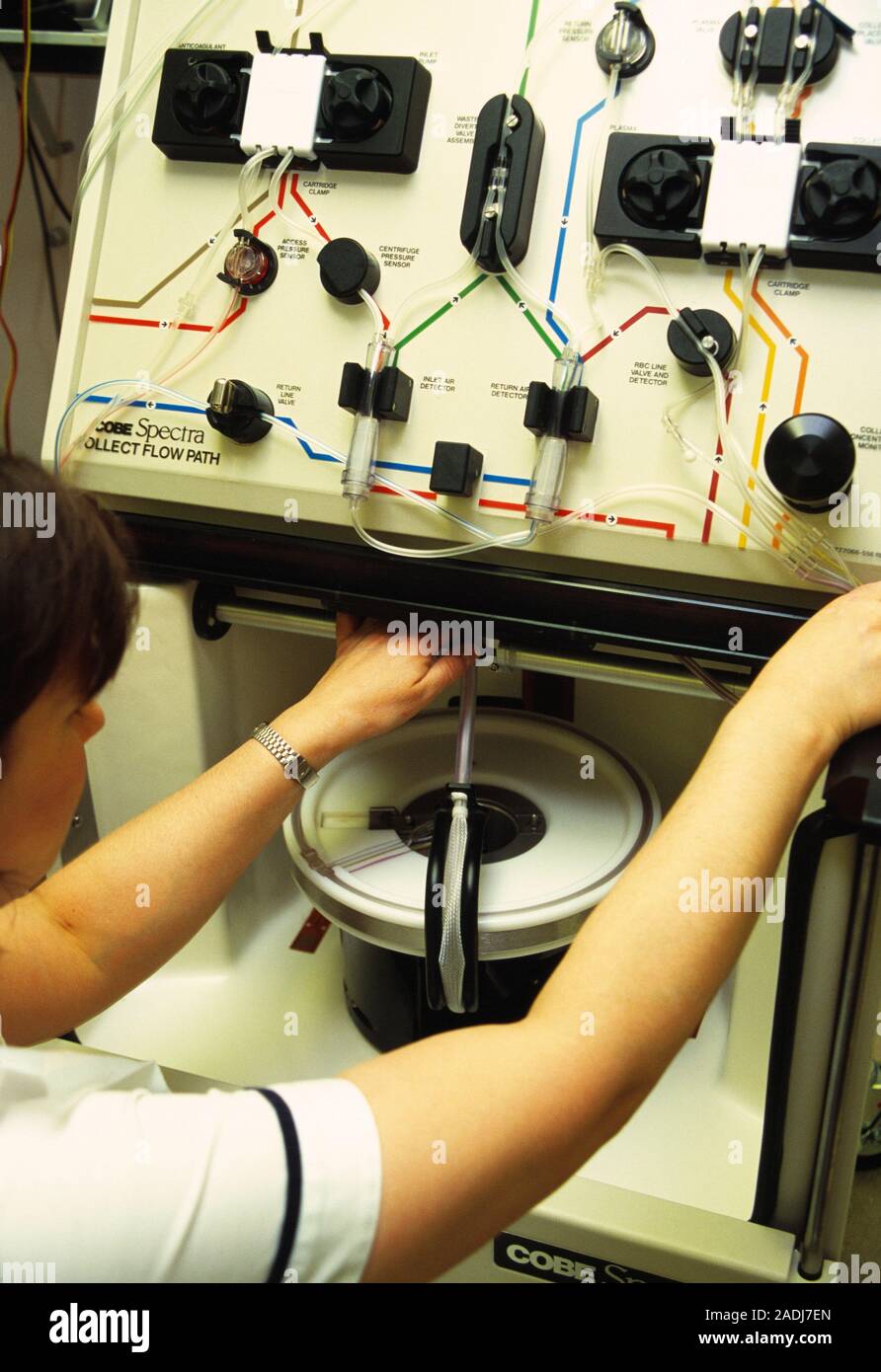 Mechanical blood separation. Nurse adjusting an apheresis machine ...