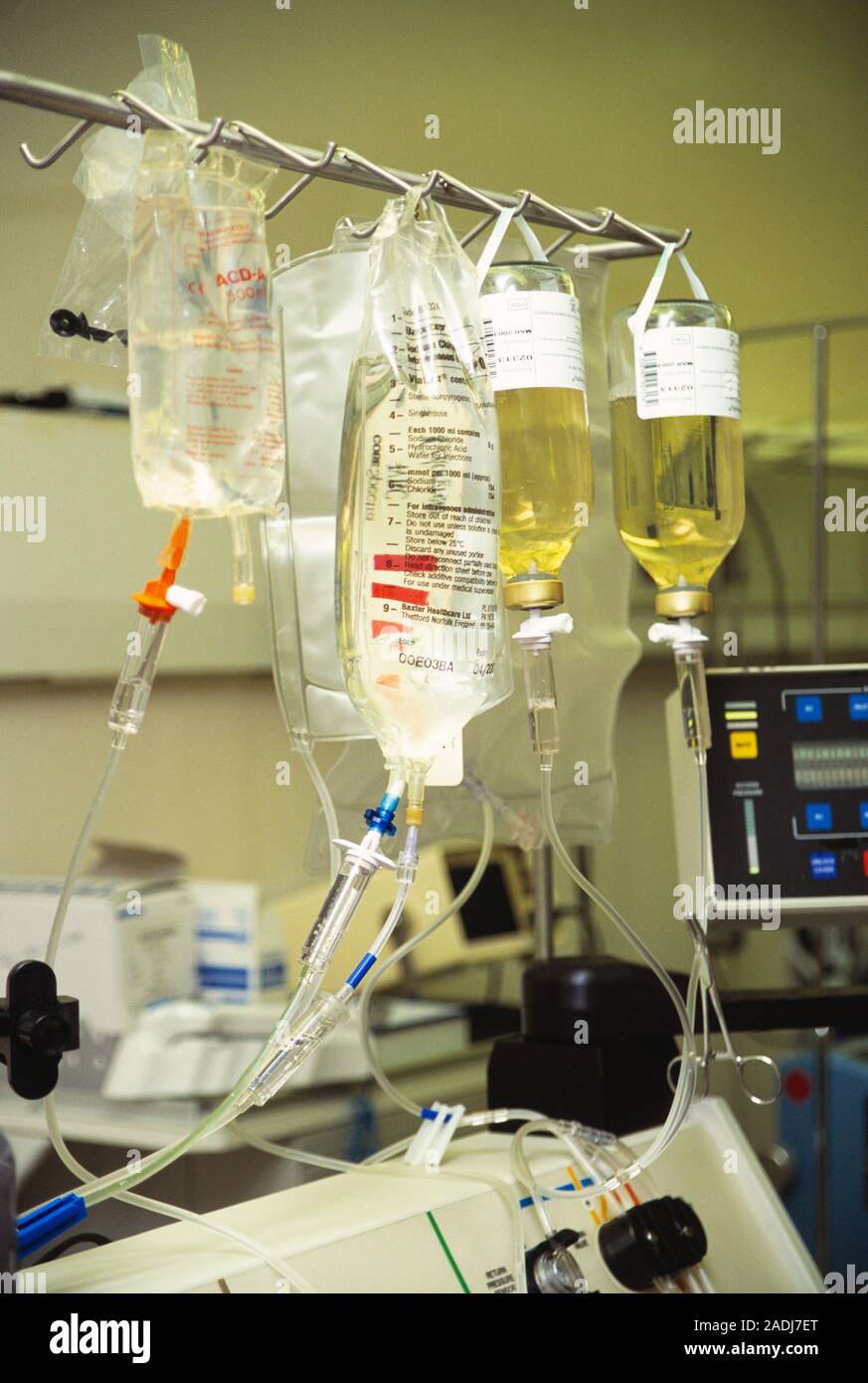 Albumin transfusion into a patient's bloodstream using intravenous (IV) drips. The albumin ...