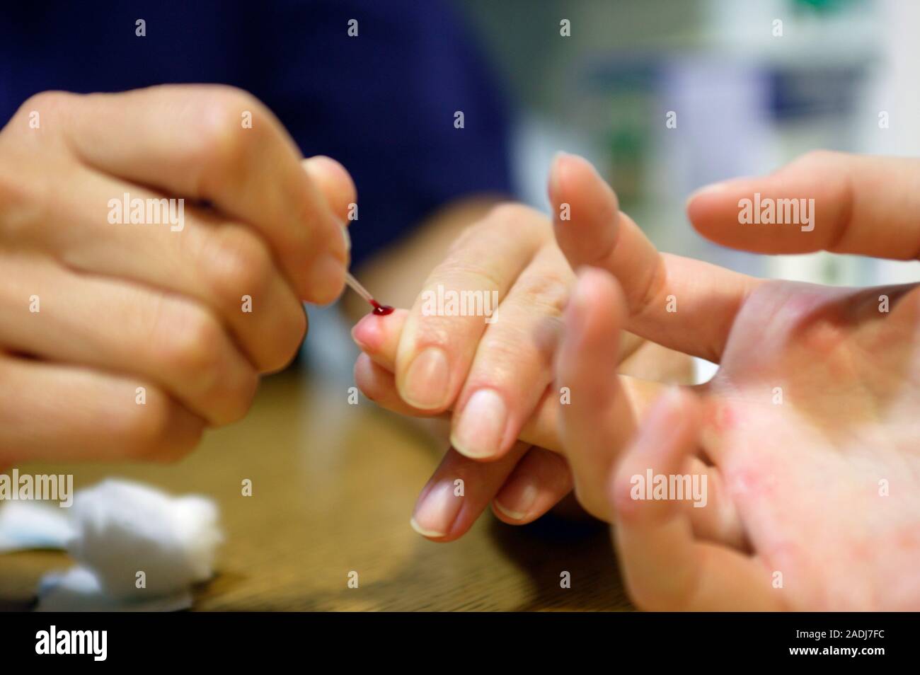 Blood sampling. Potential blood donor having a drop of blood collected ...