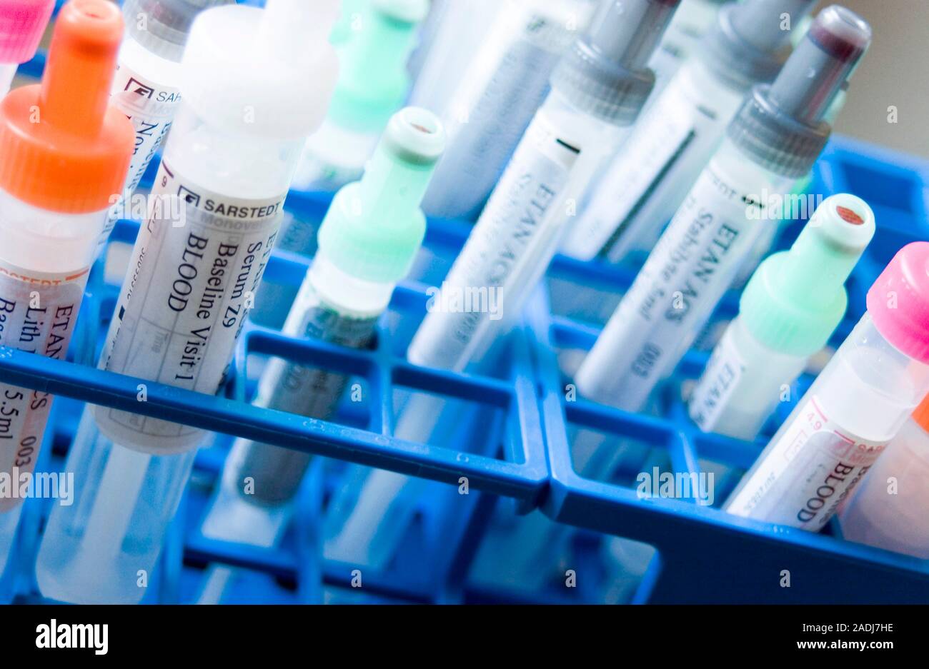 Blood sample tubes. These are S-Monovette sample tubes that combine a ...