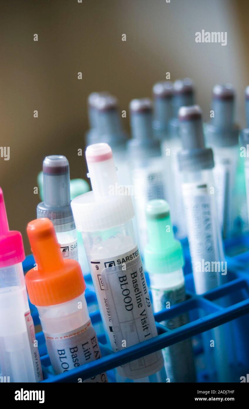 Blood sample tubes. These are S-Monovette sample tubes that combine a ...