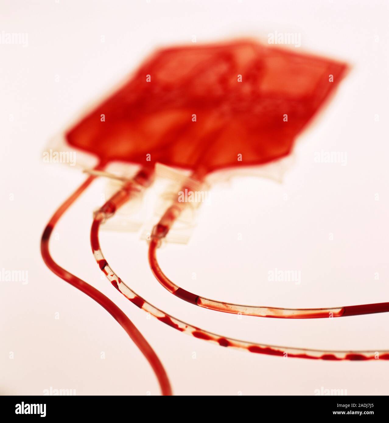 Empty blood bag. Bag of blood emptied after a transfusion. The bag was ...