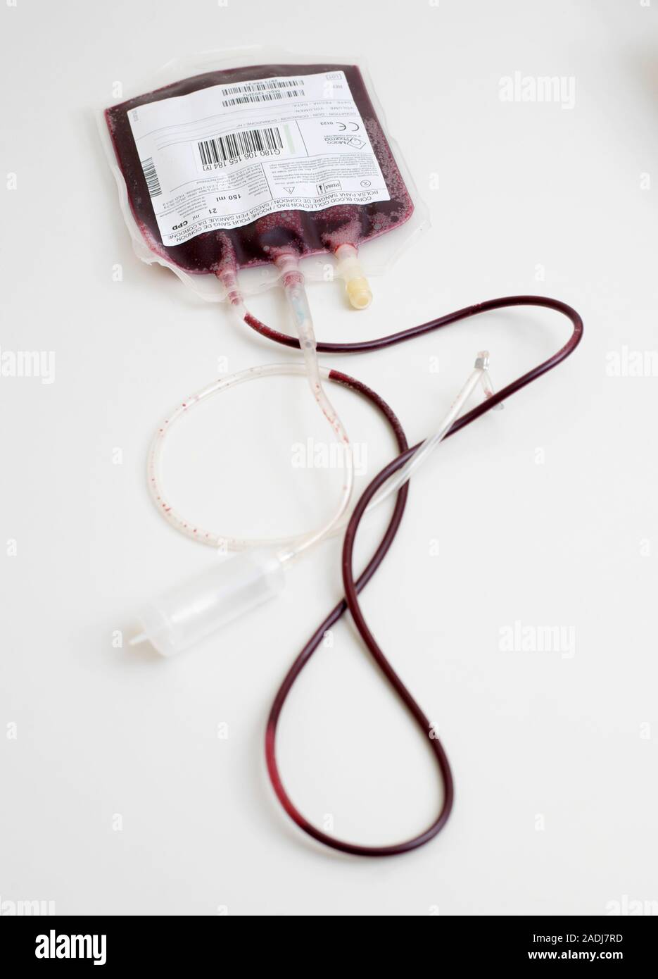 Umbilical cord blood for stem cell harvesting. Bag containing blood ...