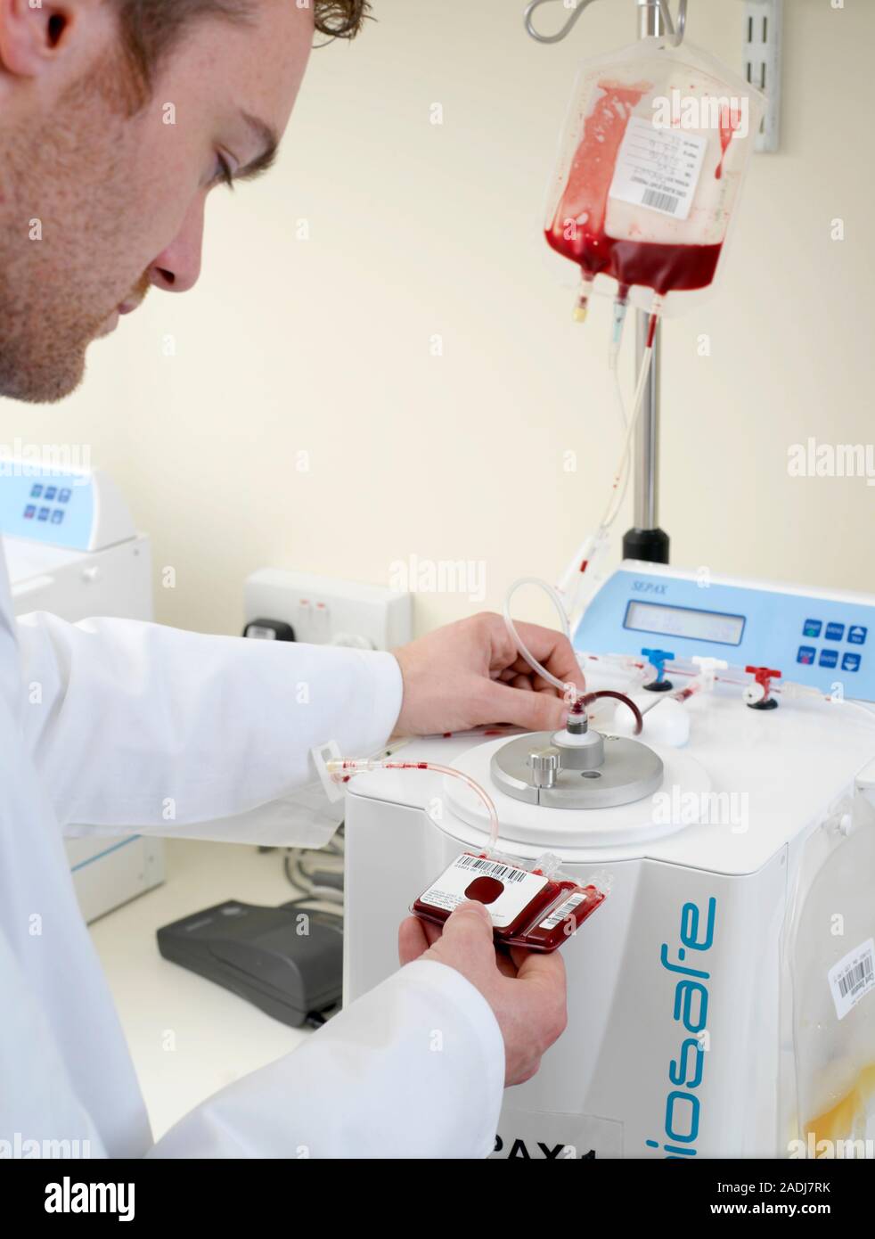 Harvesting umbilical cord blood stem cells. Technician holding a bag of ...