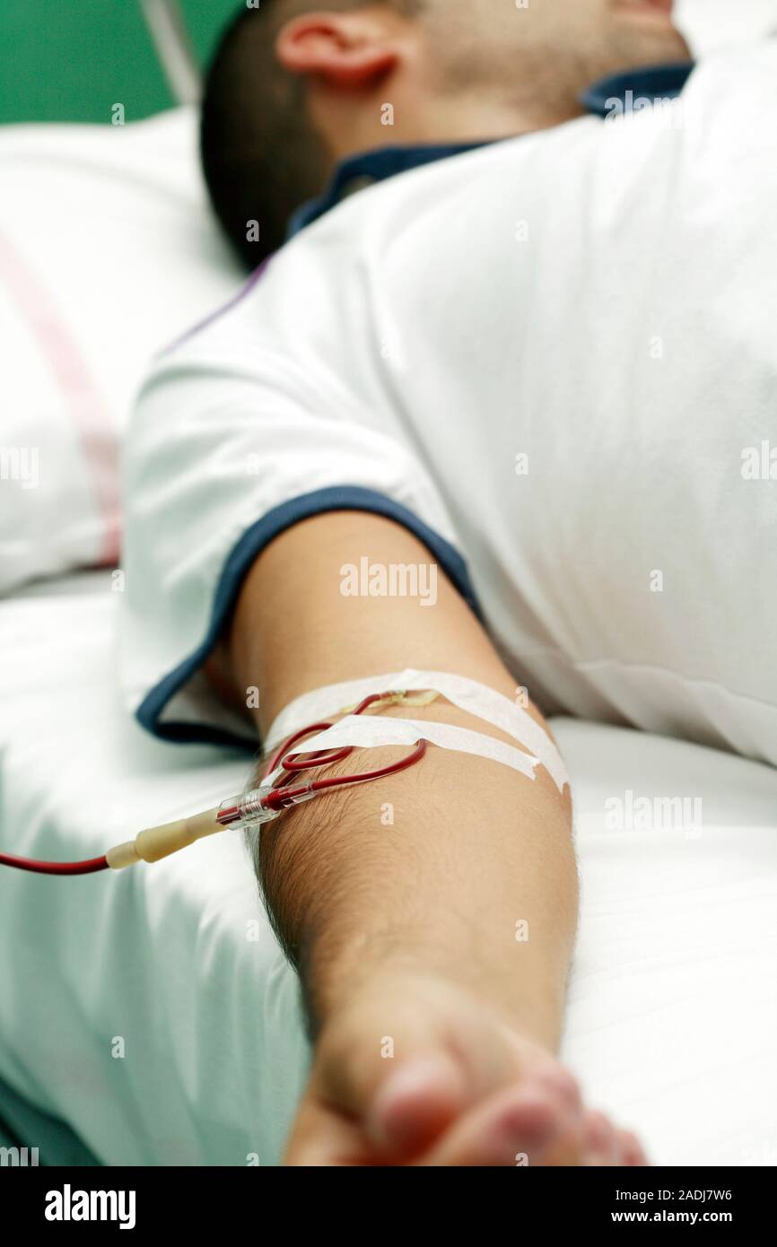 Blood transfusion. Blood-filled tubing attached to a patient's arm ...