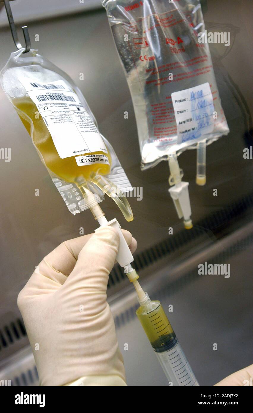 Blood sampling. Technician taking a sample from a bag of separated ...