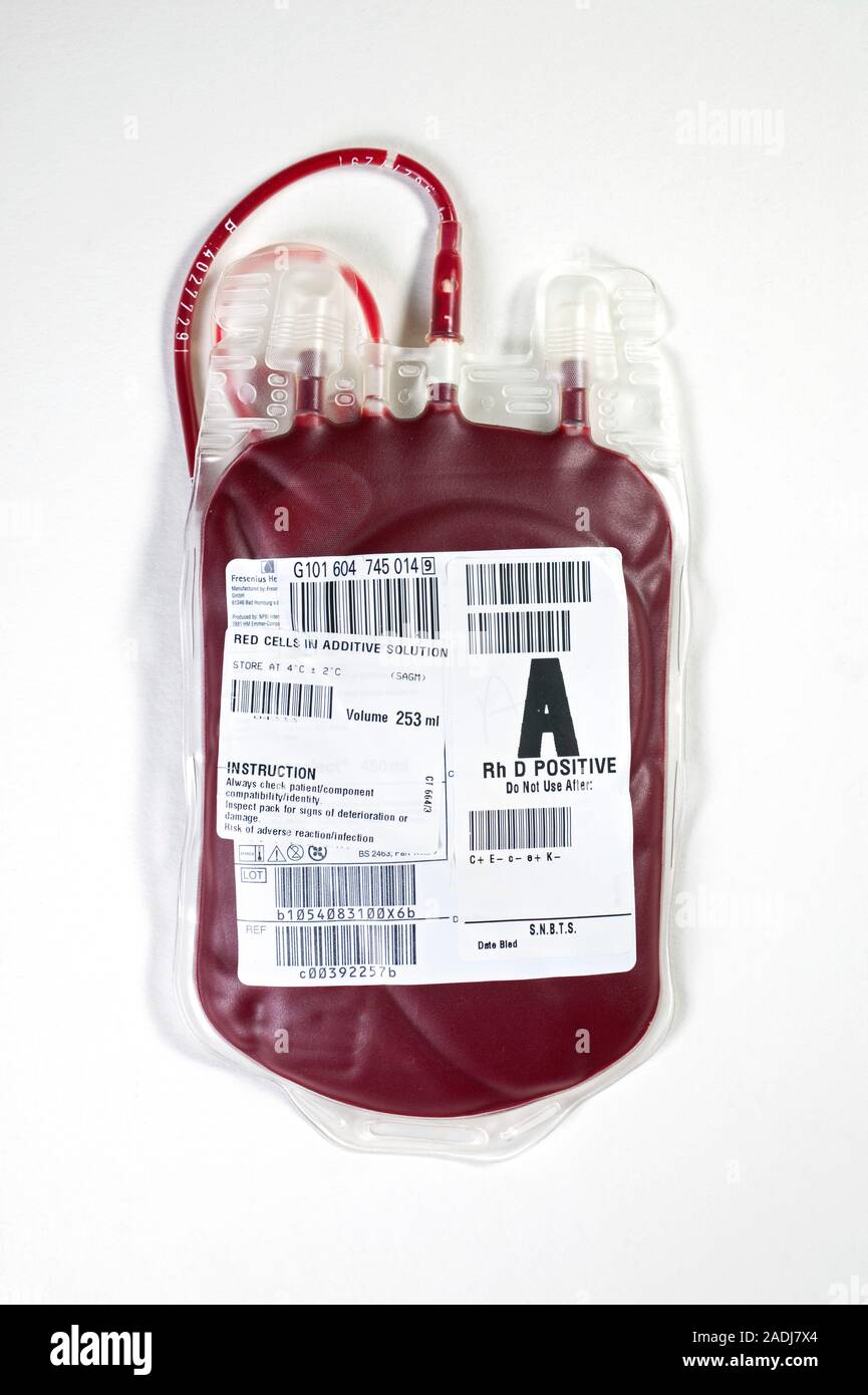 Blood bag. A positive blood inside a bag for transfusion. This blood ...