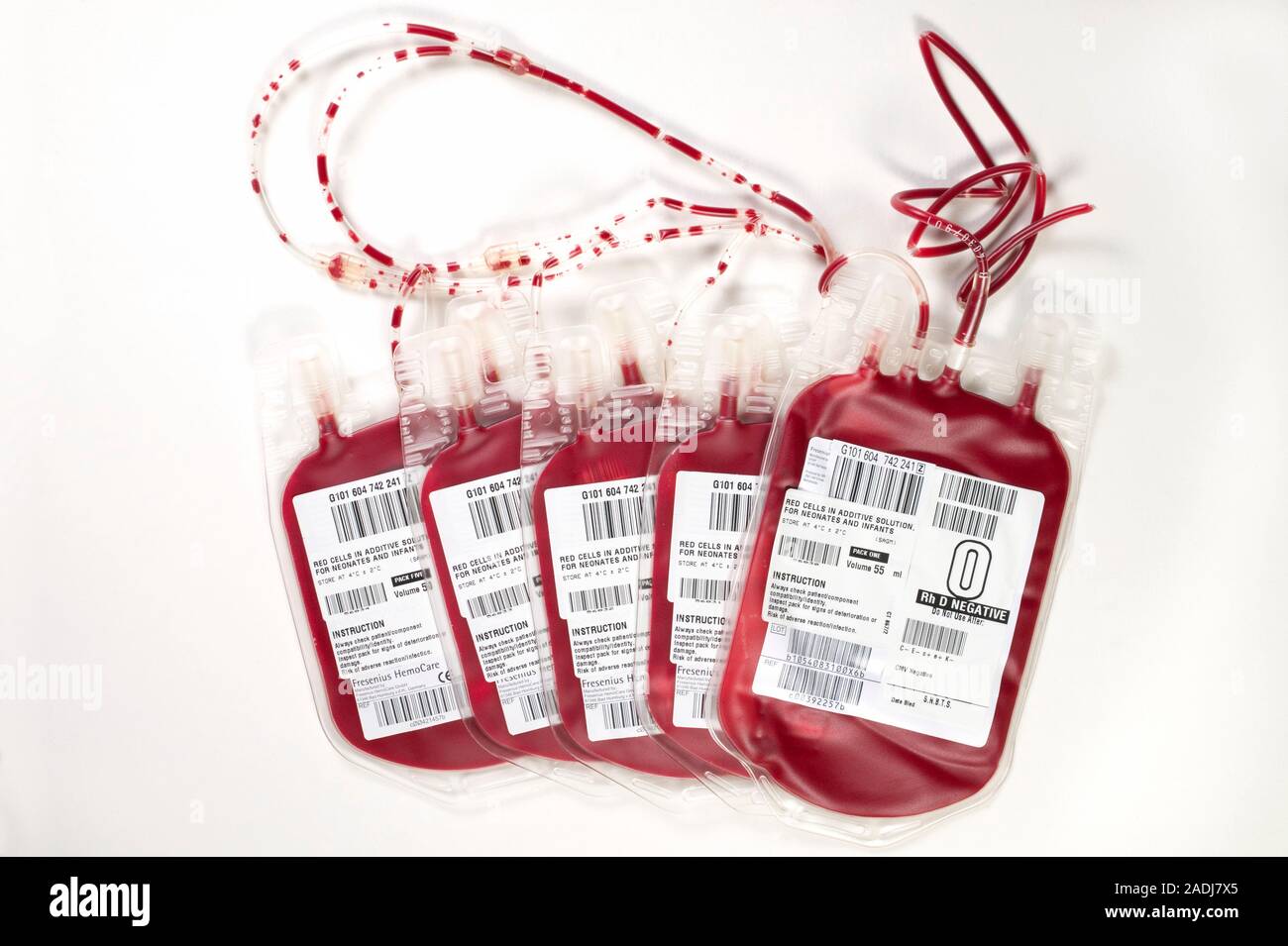 Blood bags containing O negative blood for neonate (newborn) babies and ...