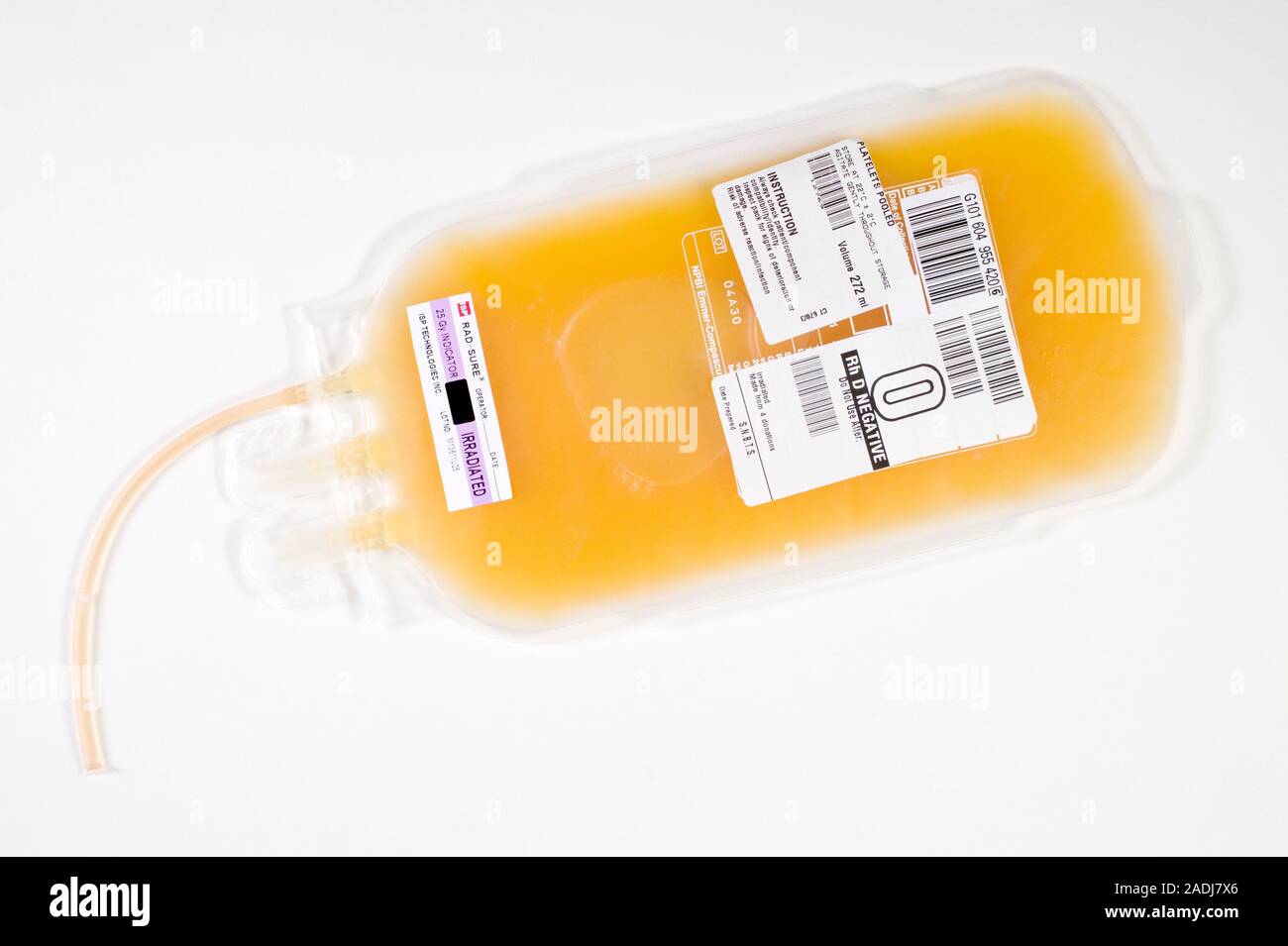 Bag of pooled blood platelets. Irradiated O negative blood platelets ...