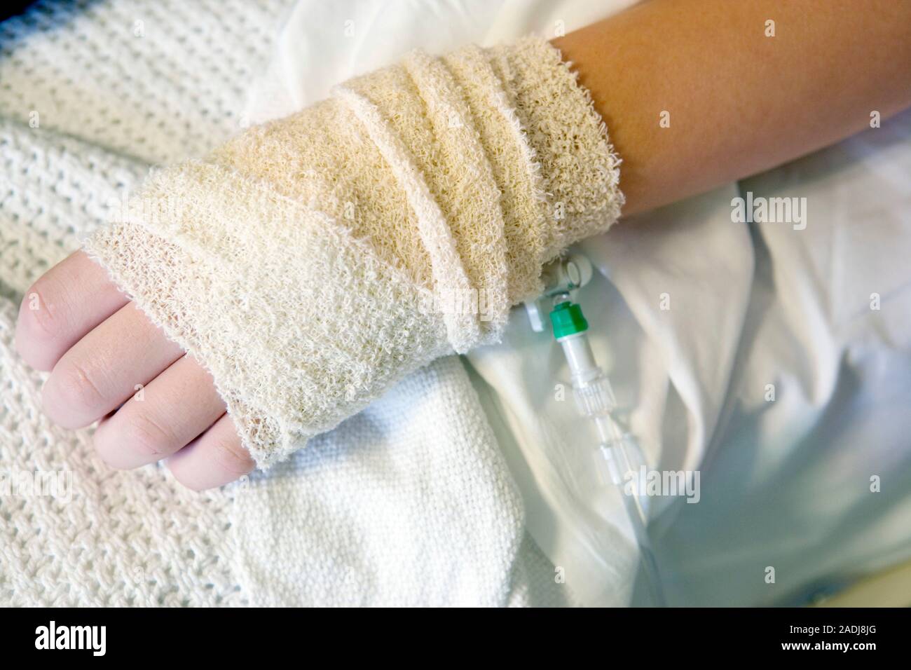 MODEL RELEASED. Intravenous drip. Child patient with a bandaged arm ...