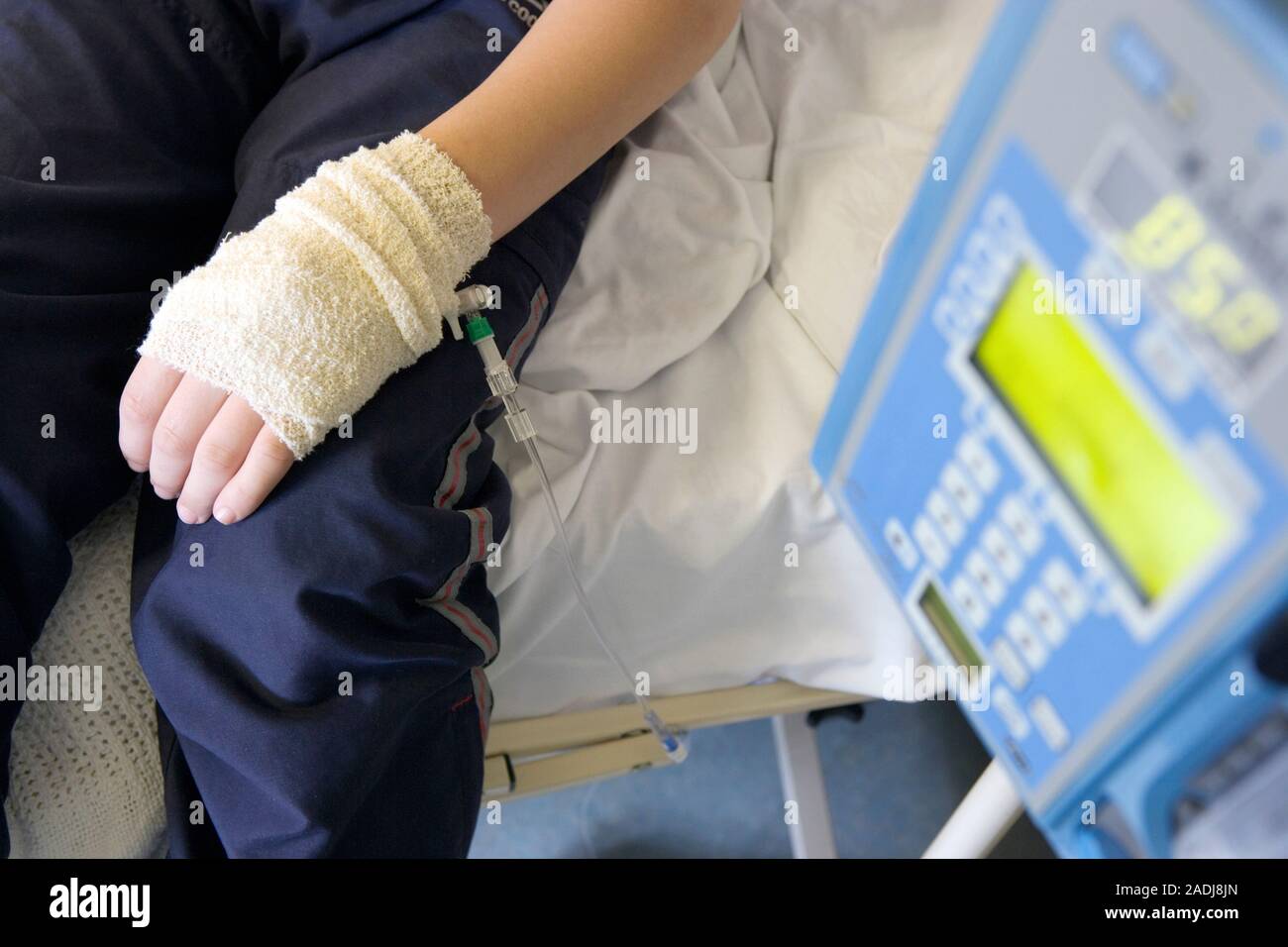 MODEL RELEASED. Intravenous drip. Child patient with a bandaged arm ...