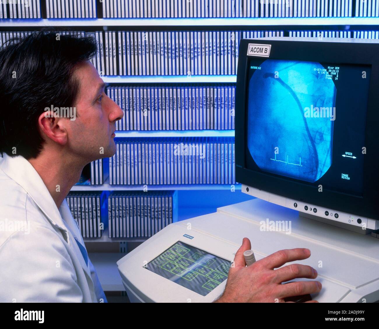 Angiography records. Radiographer using a device to study an angiogram ...