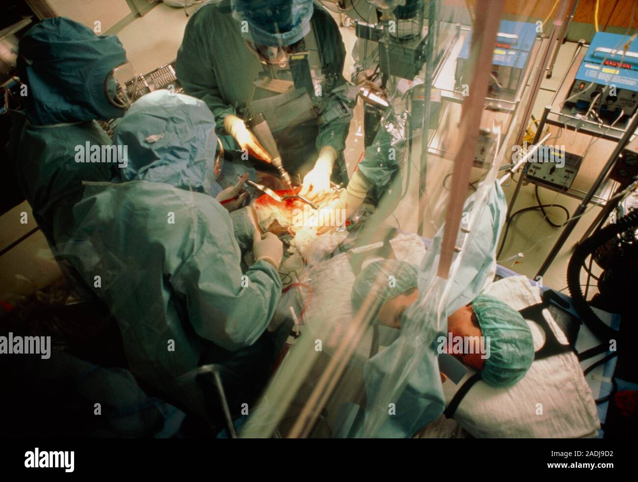 Orthopaedic surgery to replace a young man's hip joint with a ball ...