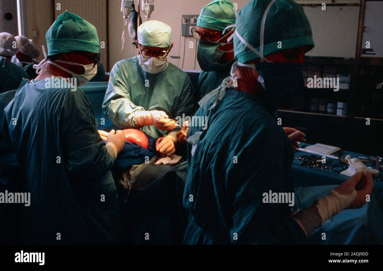 Fetal surgery through an open uterus: the surgeons are debating the ...