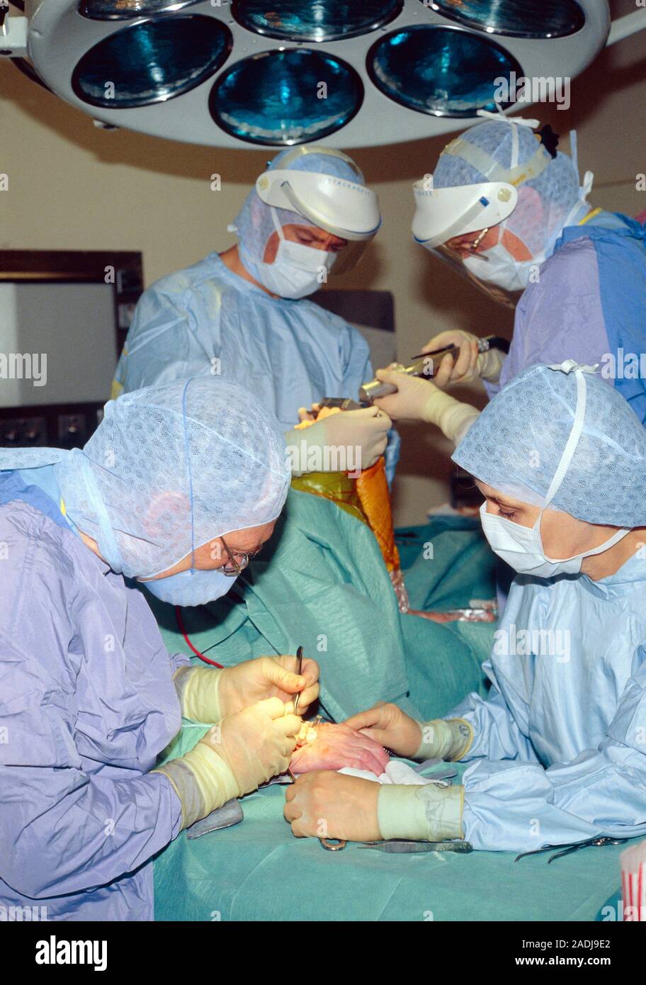 Simultaneous surgery. Surgeons operate on the knee and wrist of a ...