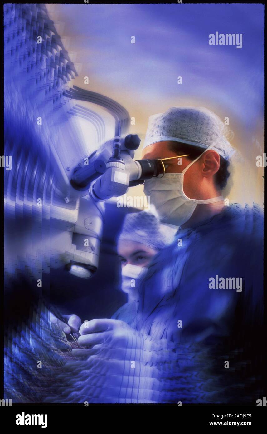 Microsurgery. Multiple-exposure zoom effect of a surgeon conducting ...