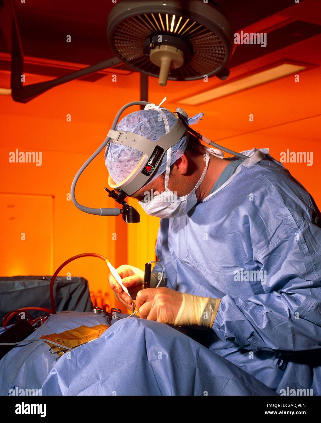 Neck fusion surgery. Surgeon performs a neck fusion operation in a ...