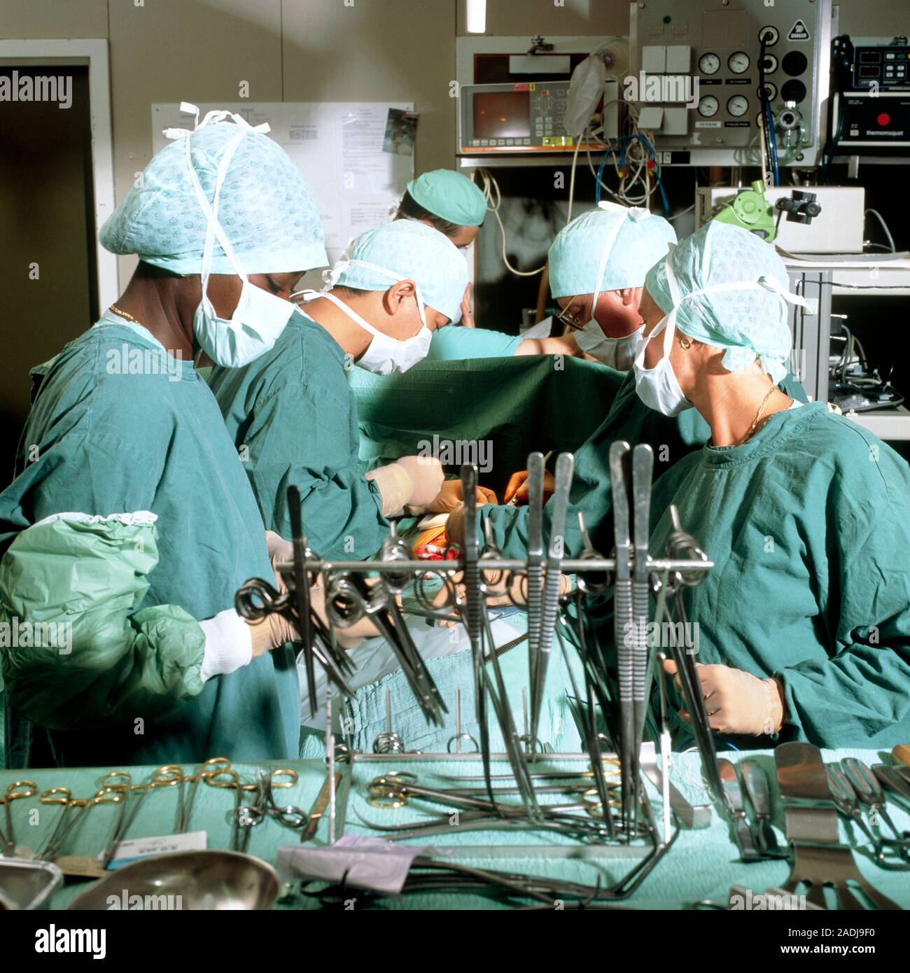 Lung surgery. View of a team of surgeons performing an operation on the ...